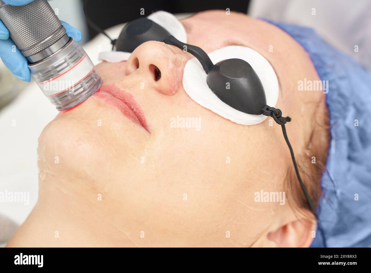 Light infrared therapy. Cosmetology head procedure. Beauty woman face ...
