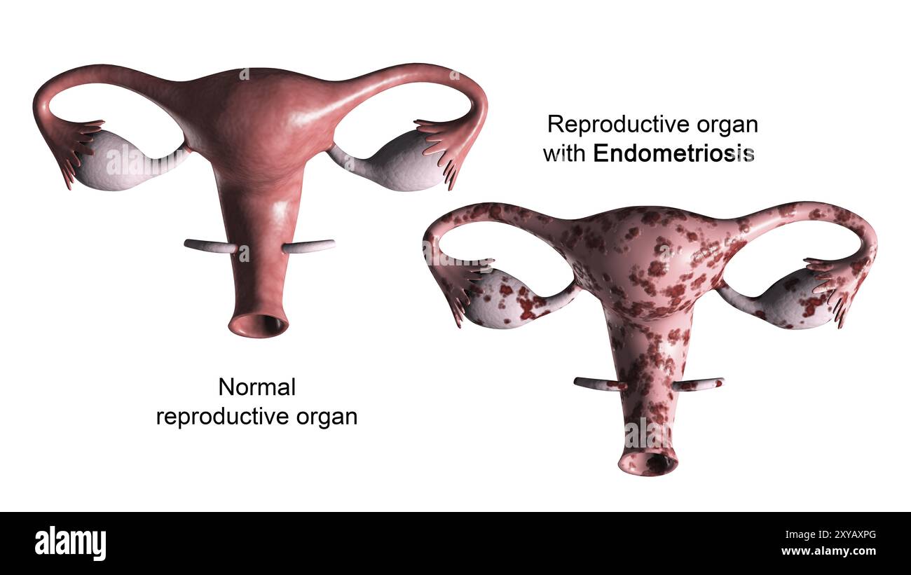 Reproductive organ of a flower hi-res stock photography and images - Alamy