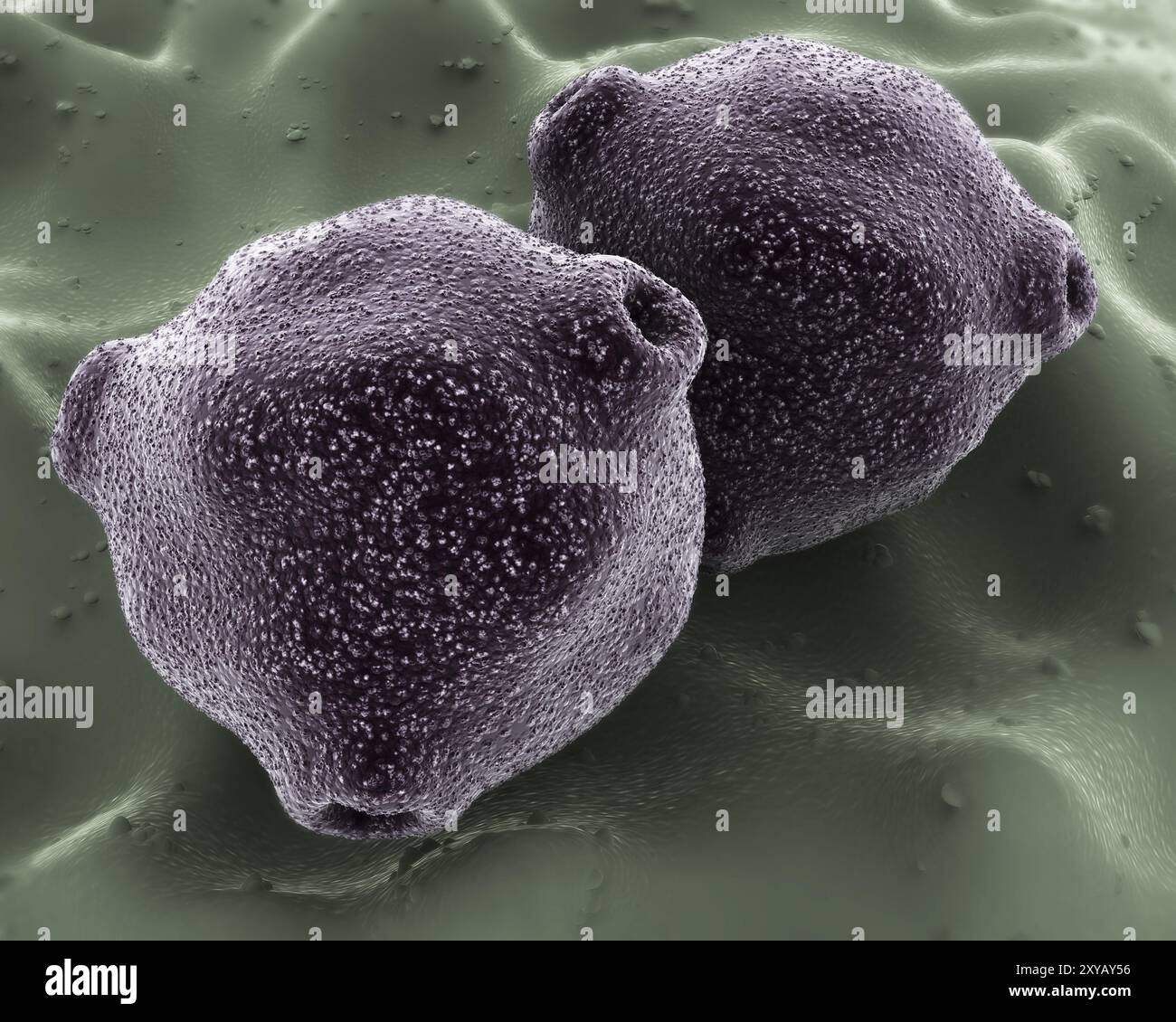 Microscopic view of birch tree pollen. Birch tree pollen is considered ...