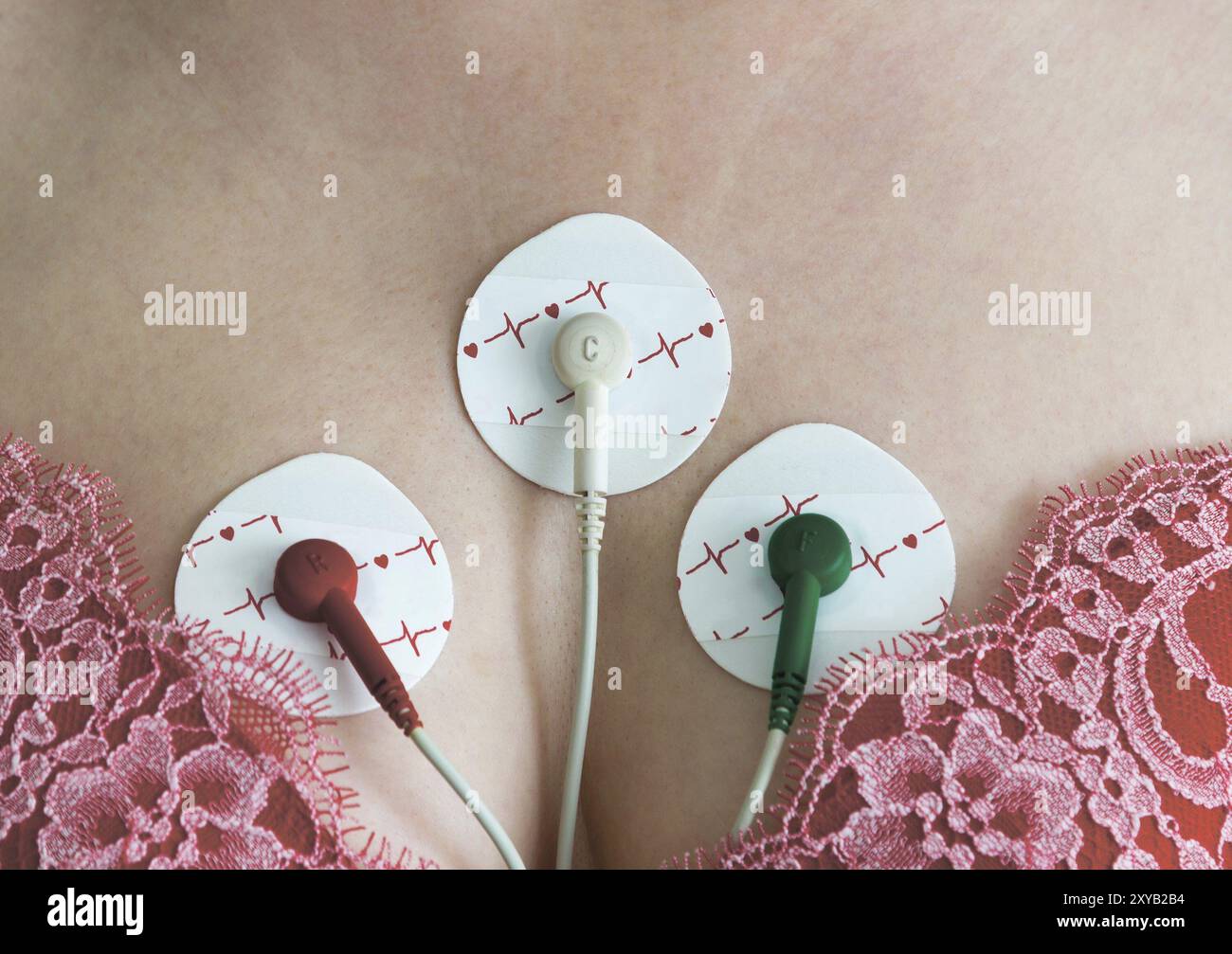 Electrodes Holter monitoring on the chest of a woman Stock Photo - Alamy
