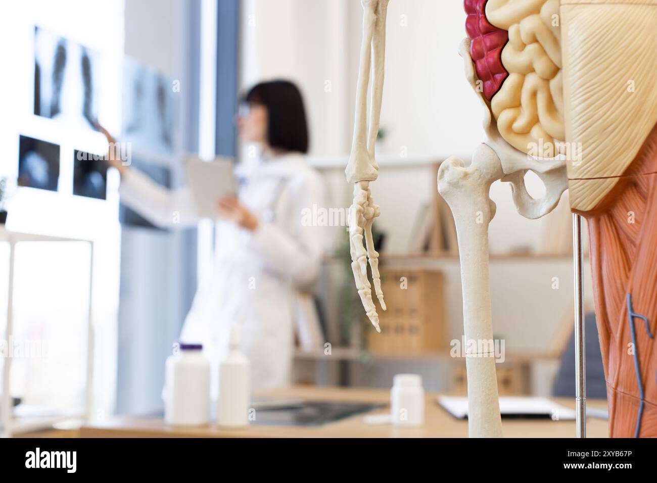 Medical professional examining X-rays with anatomical model in focus ...