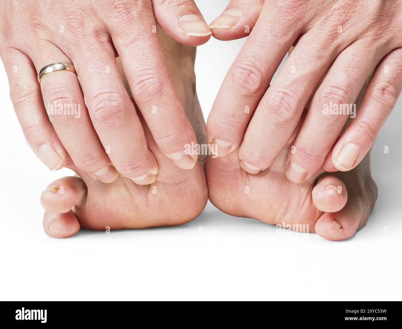 Hands pulling toes on barefoot feet with shadow effect Stock Photo - Alamy