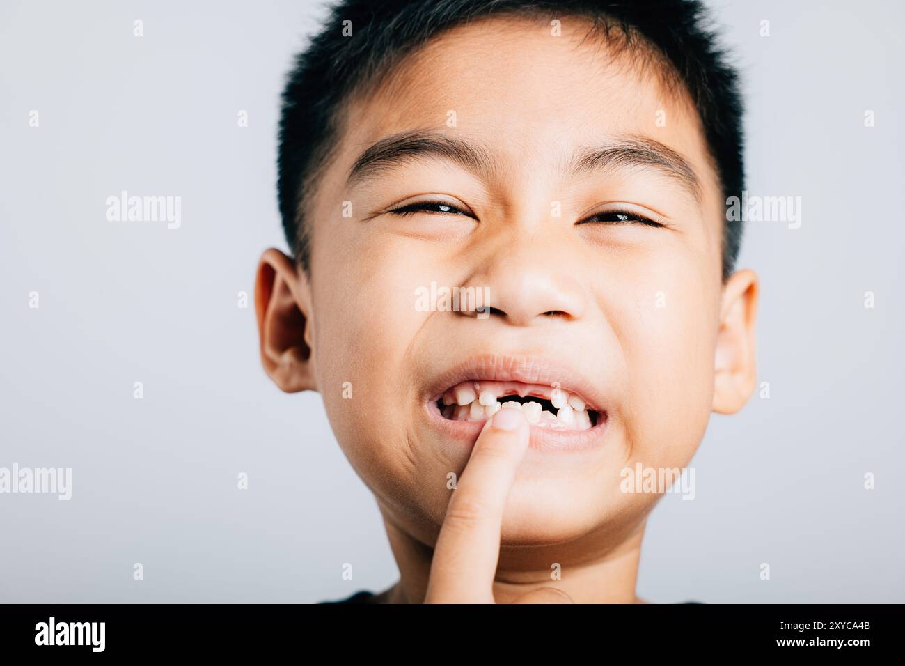 Six year old schoolboy happily points to growing molar gap. cheerful ...