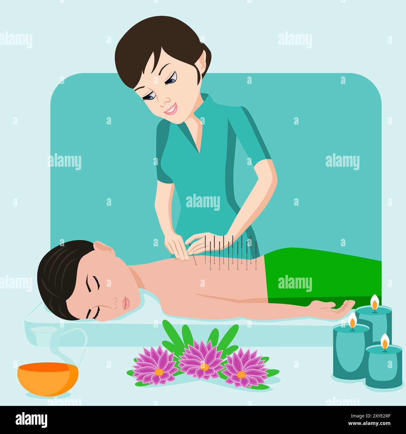 Needle Acupuncture treatment by professional acupuncturist in spa ...