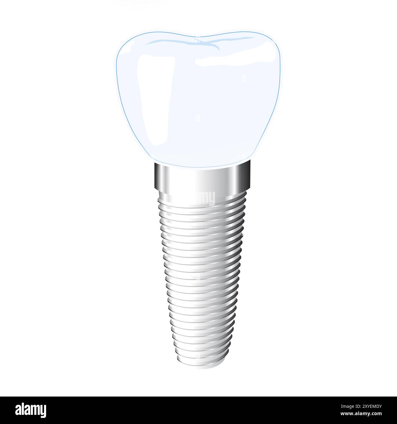 Tooth dental implant vector hi-res stock photography and images - Alamy