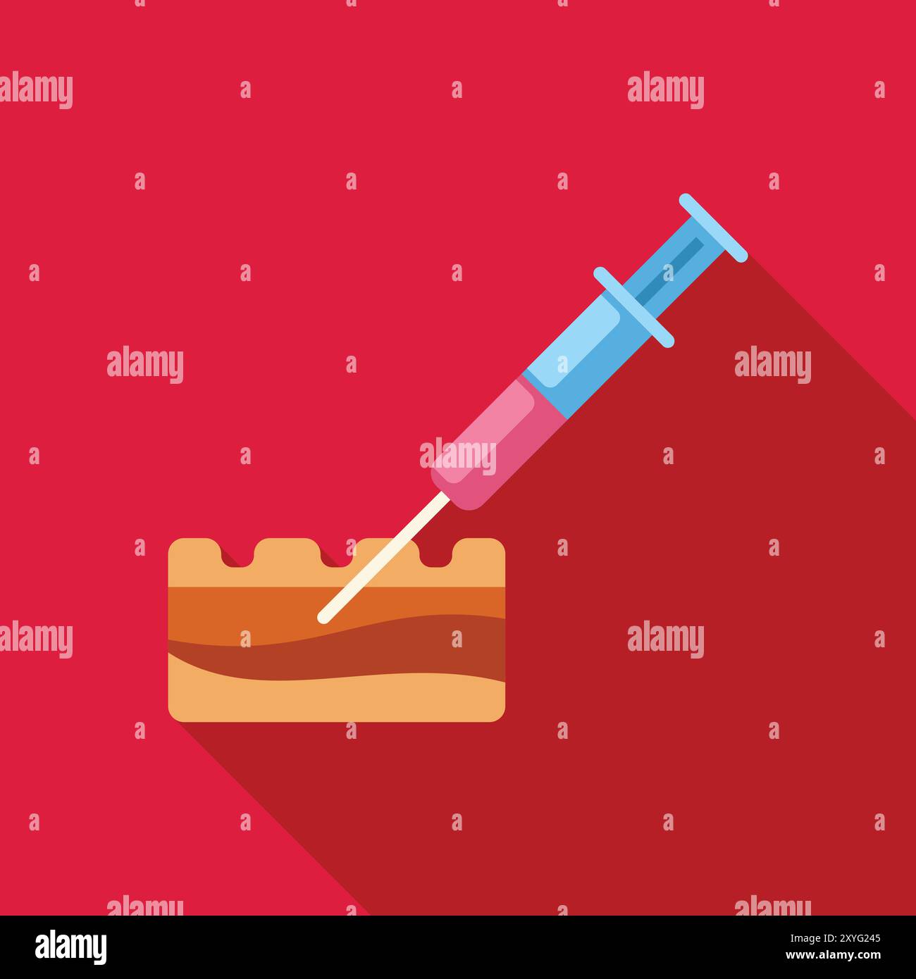 Syringe injecting a substance into skin layers, illustrating a medical ...