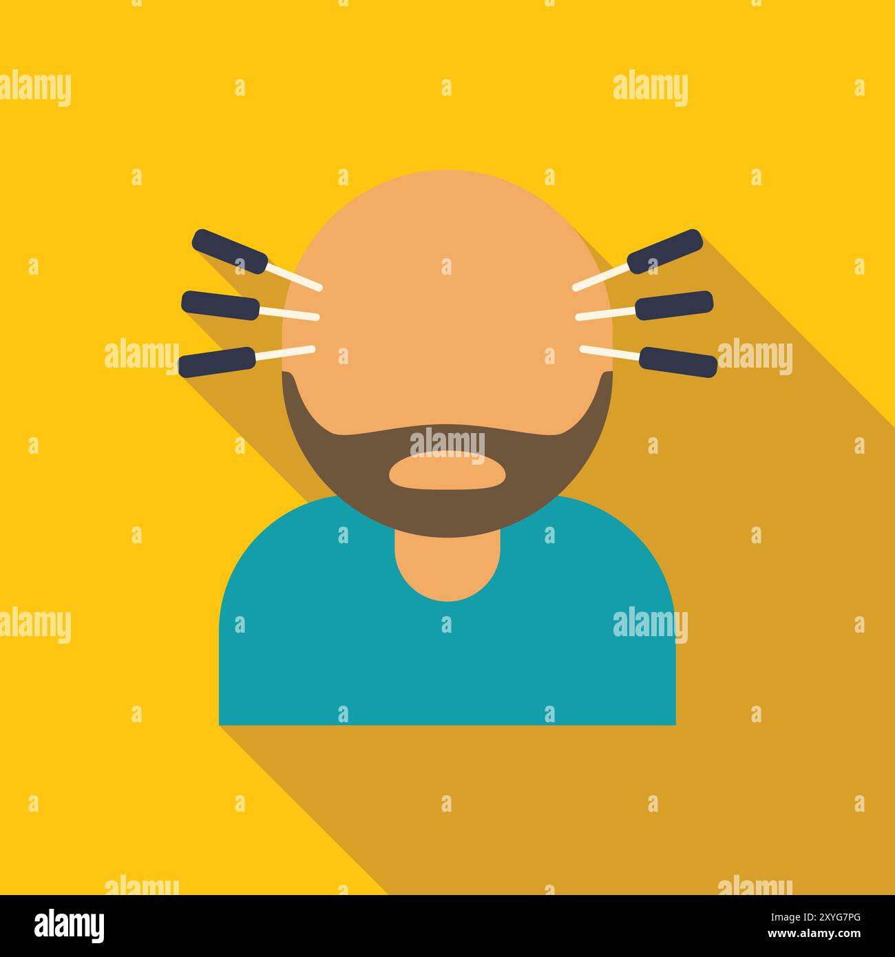 Bearded man is receiving acupuncture treatment on his forehead, a ...