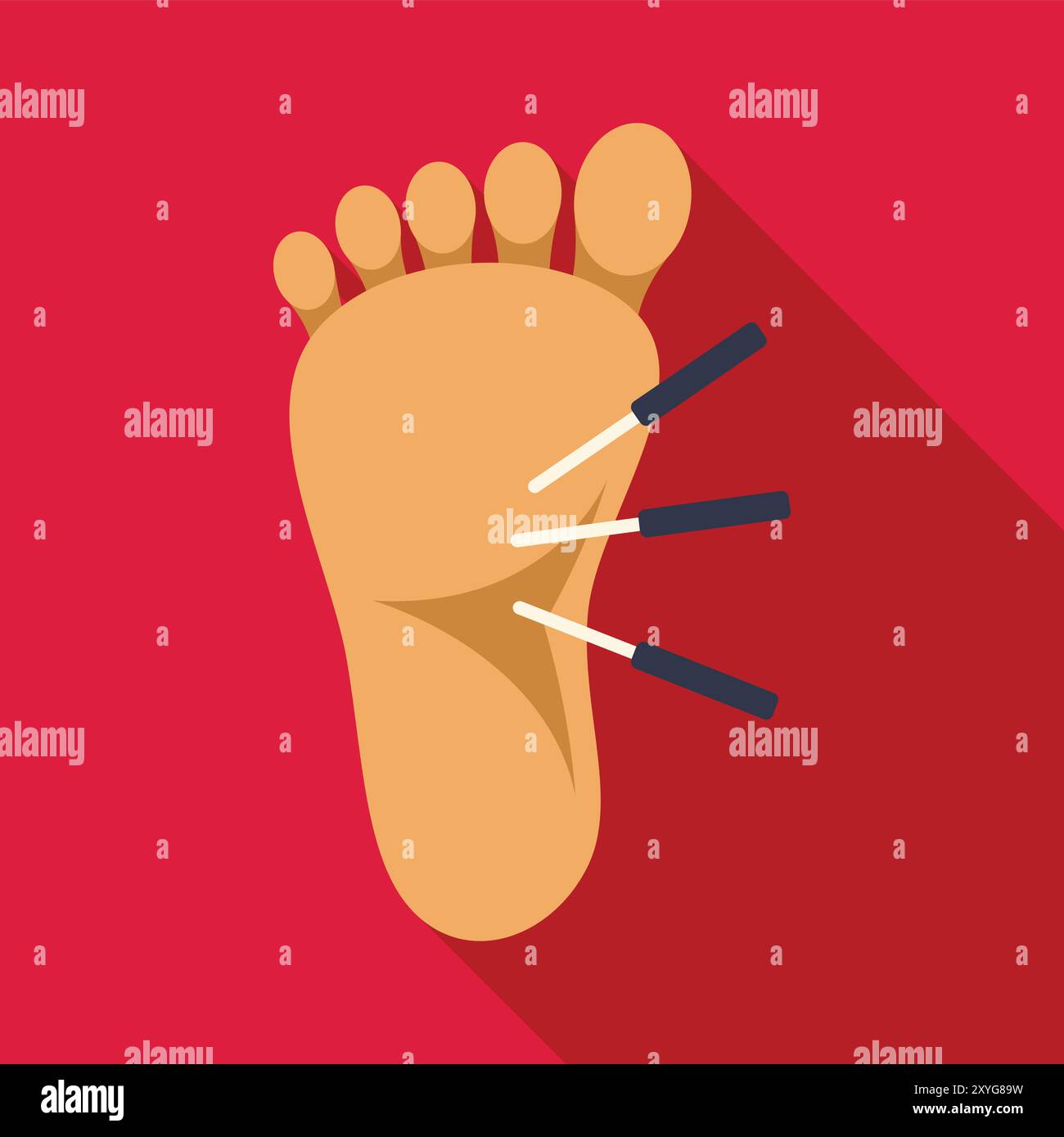Acupuncture technique Stock Vector Images - Alamy