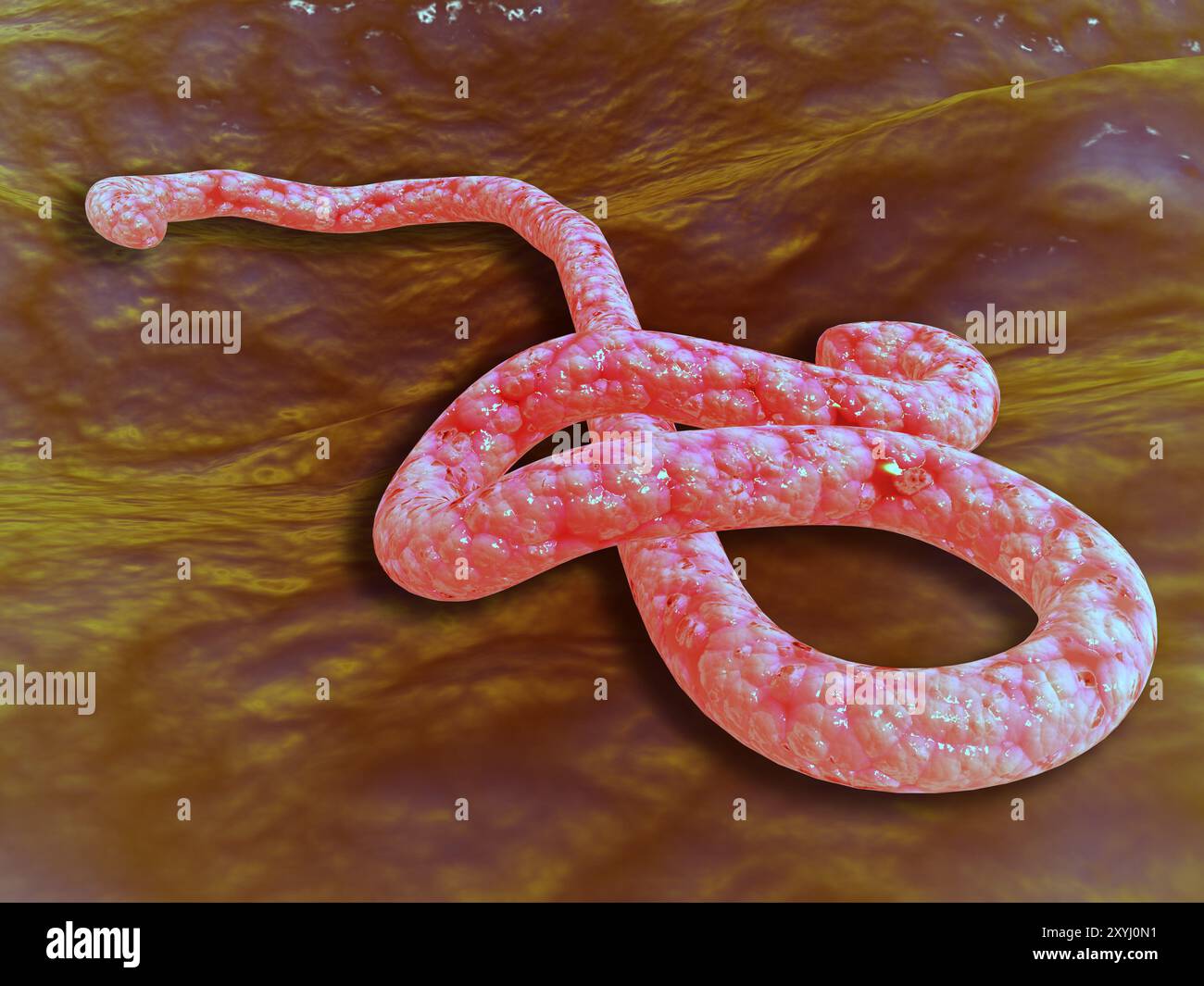 Microscopic view of Ebola virus (EBOV) . EBOV causes extremely severe ...