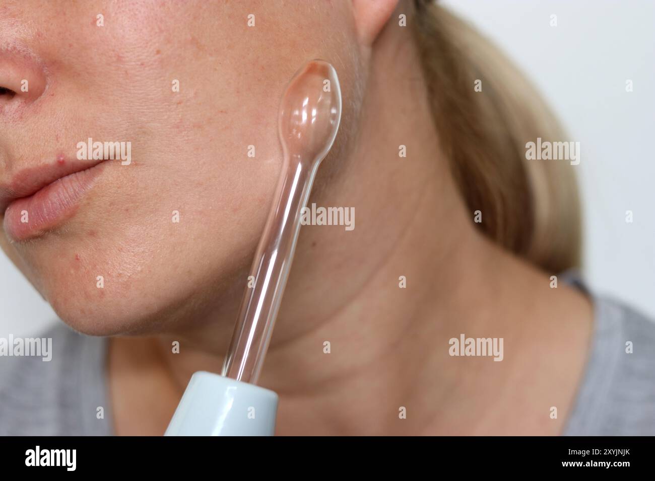 High frequency device hi-res stock photography and images - Alamy