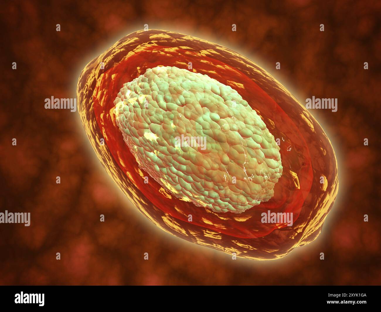 Microscopic view of samllpox. Smallpox is an acute contagious disease ...
