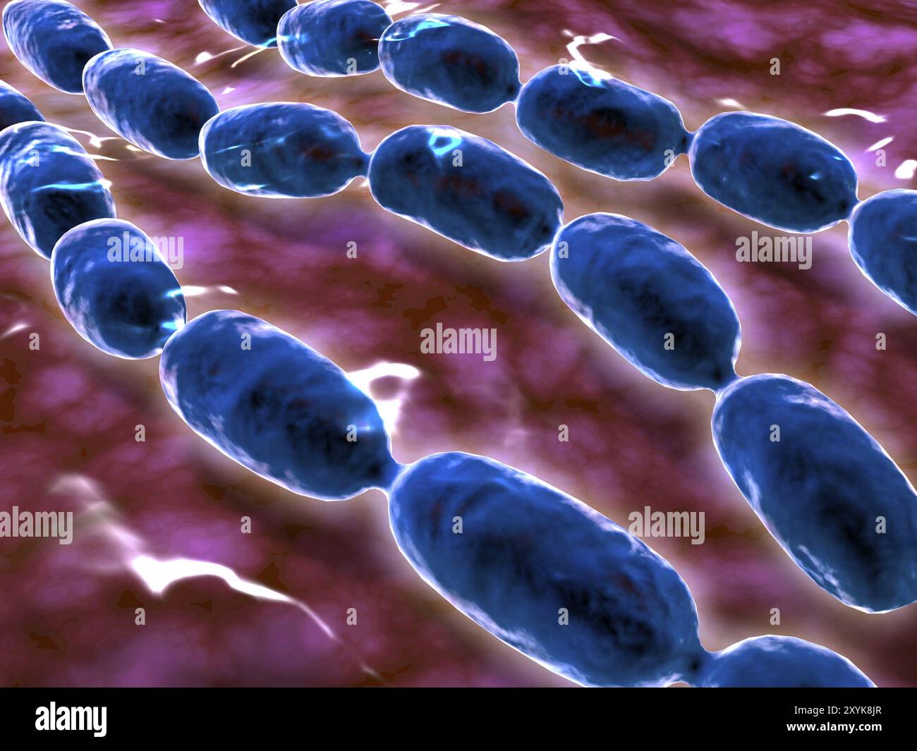 Microscopic view of bacterial pneumonia. Bacterial pneumonia is a type ...
