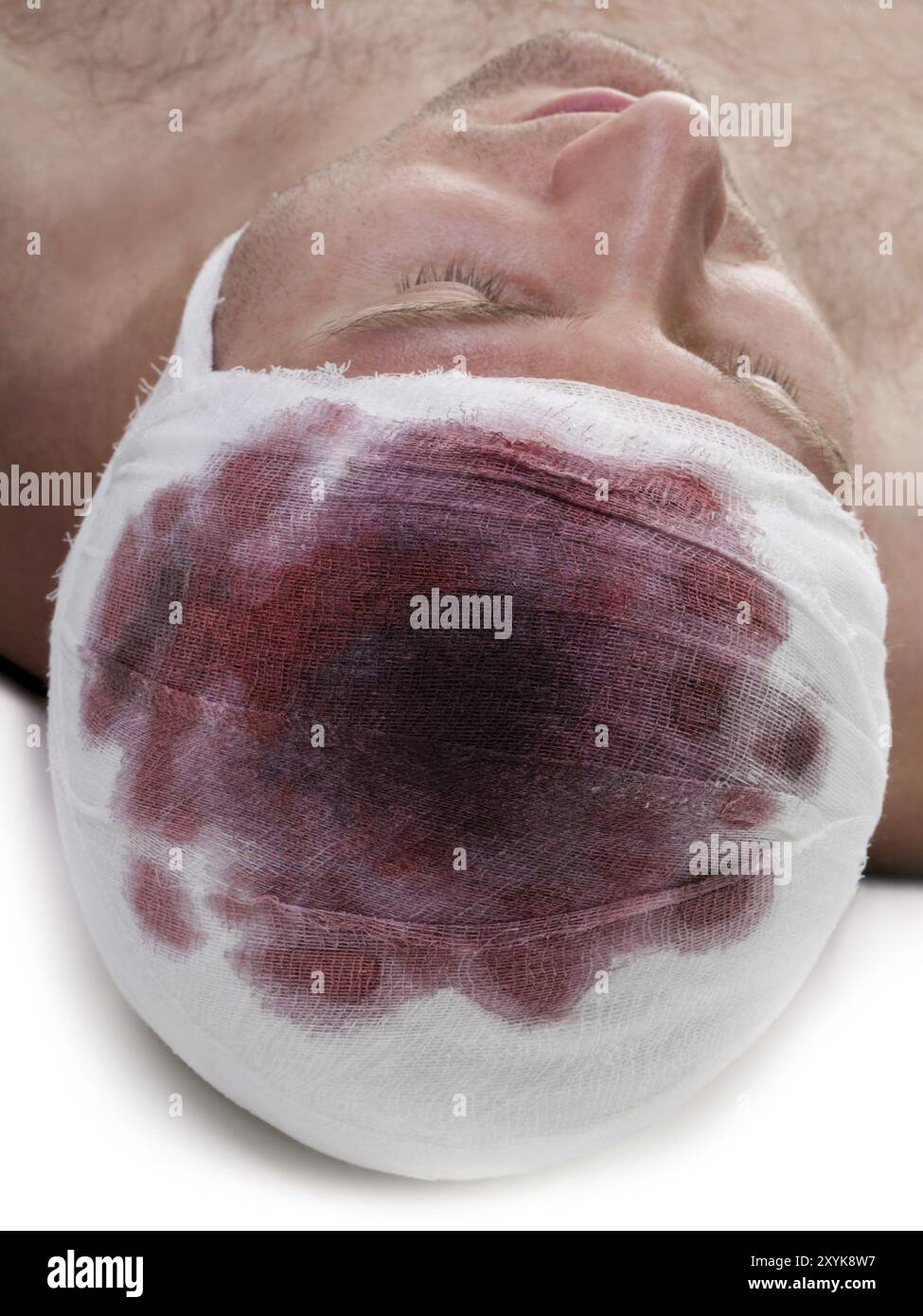 Bandage on human brain concussion blood wound head Stock Photo - Alamy