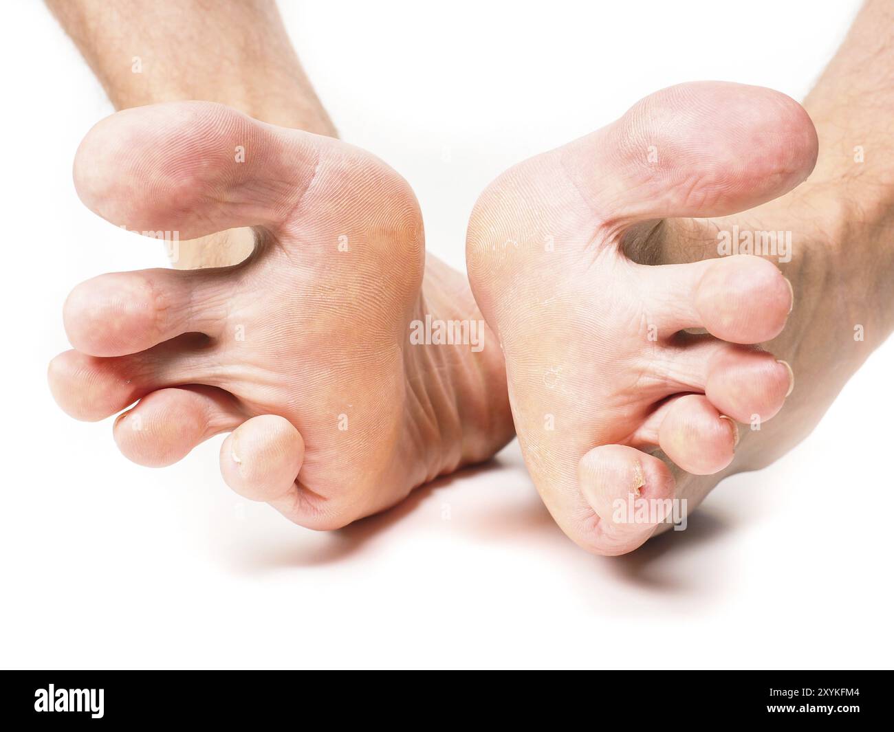 Male toes hi-res stock photography and images - Alamy