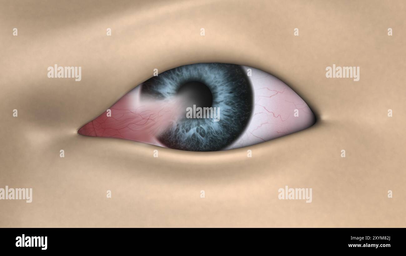 Showing the anatomy of the eye hi-res stock photography and images - Alamy