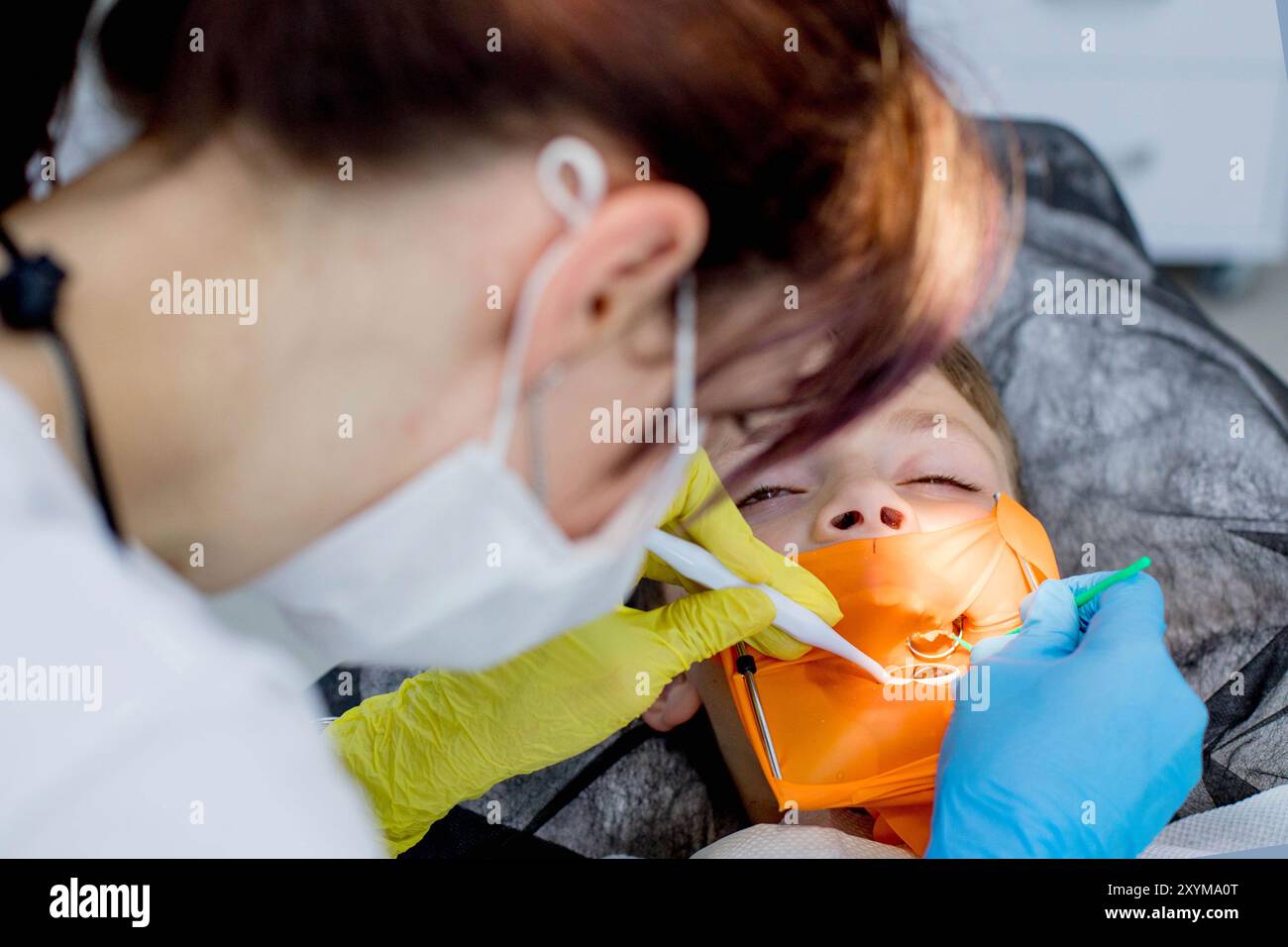 Dentist treats the child's tooth using a rubber dam Stock Photo - Alamy