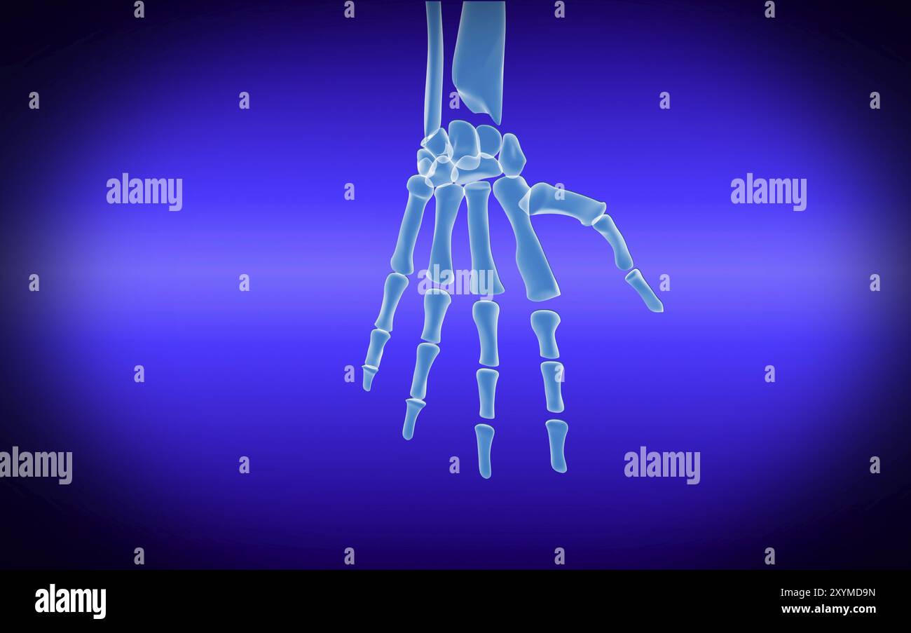 Exposed to x rays hi-res stock photography and images - Alamy