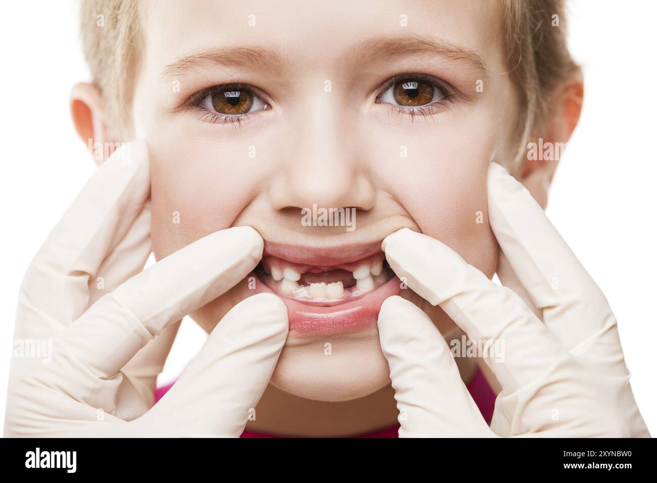Dental medicine and healthcare, child patient open mouth showing first ...
