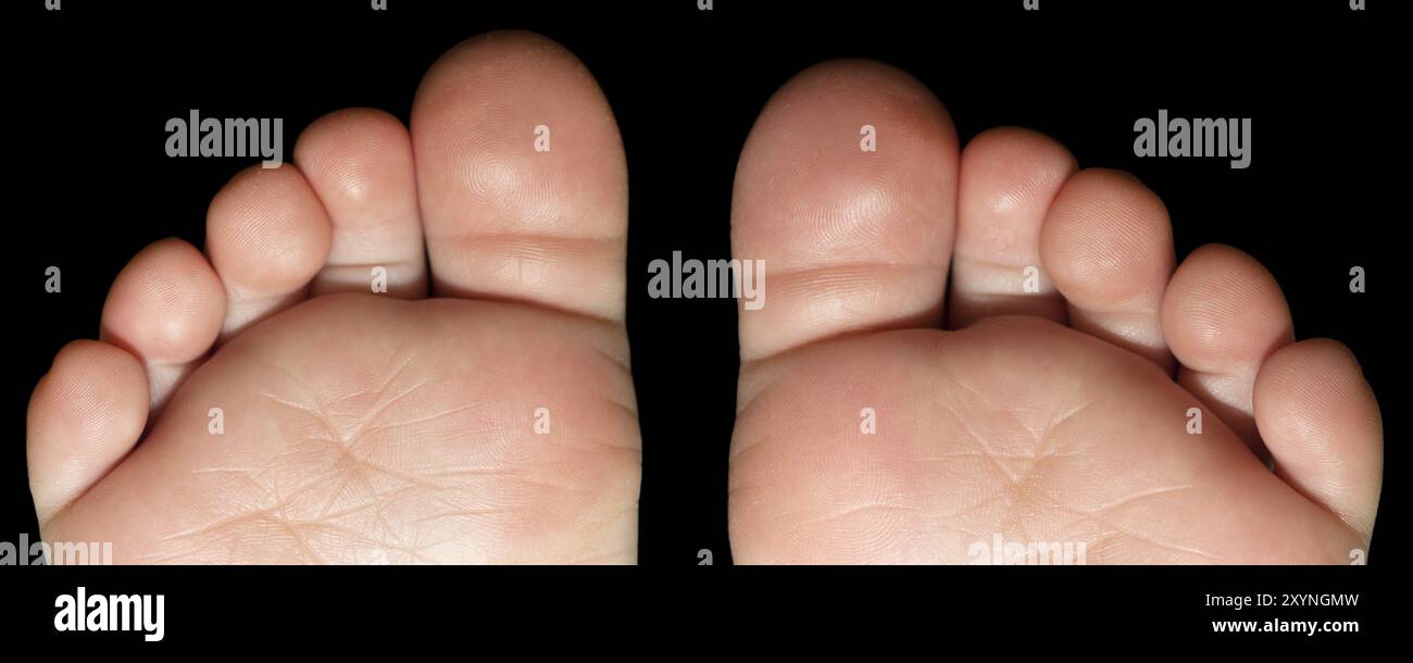 Child toes feet soles hi-res stock photography and images - Alamy