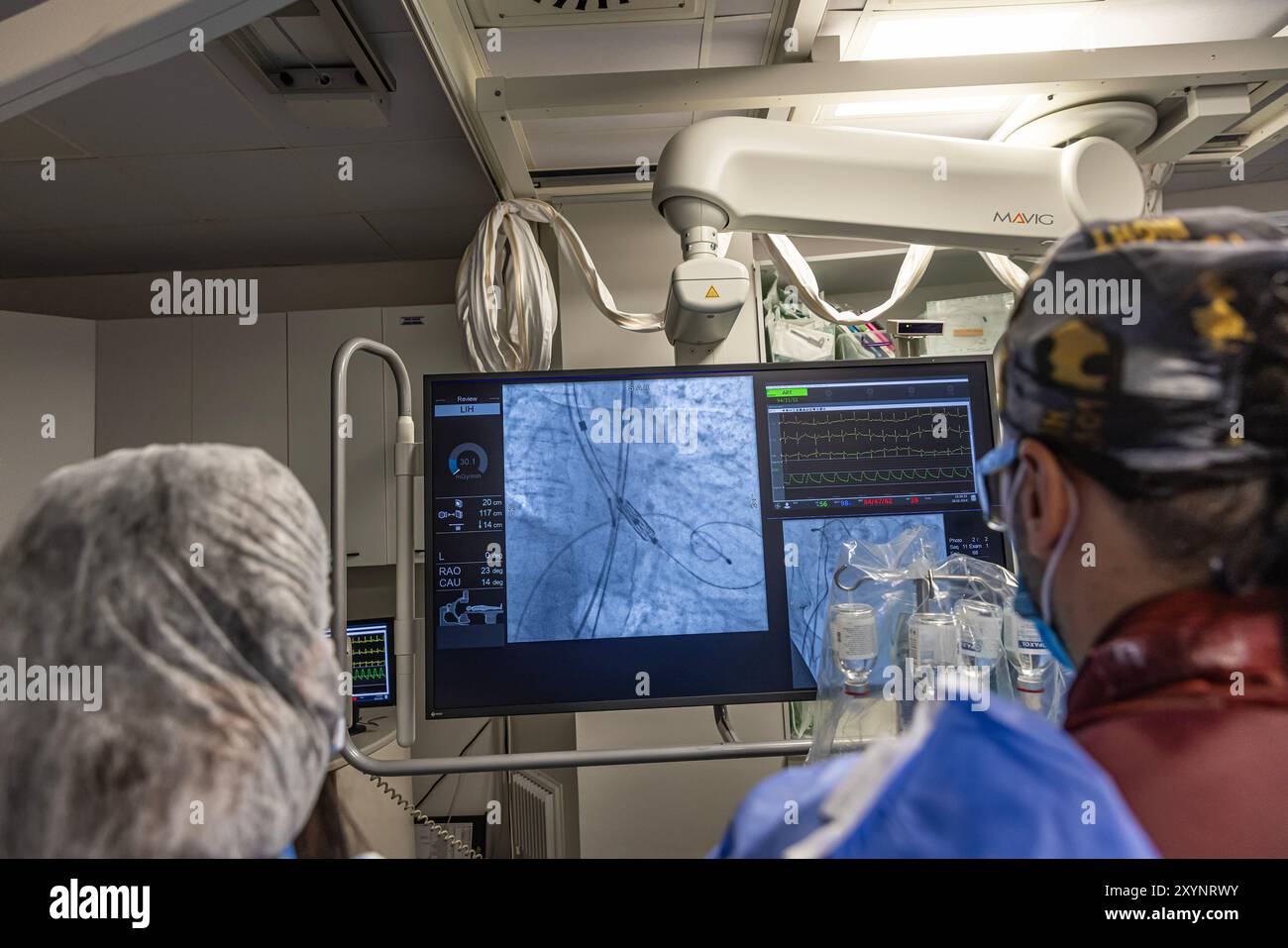 Istanbul, Turkey February 29, 2024; X-ray for valvular replacement with ...