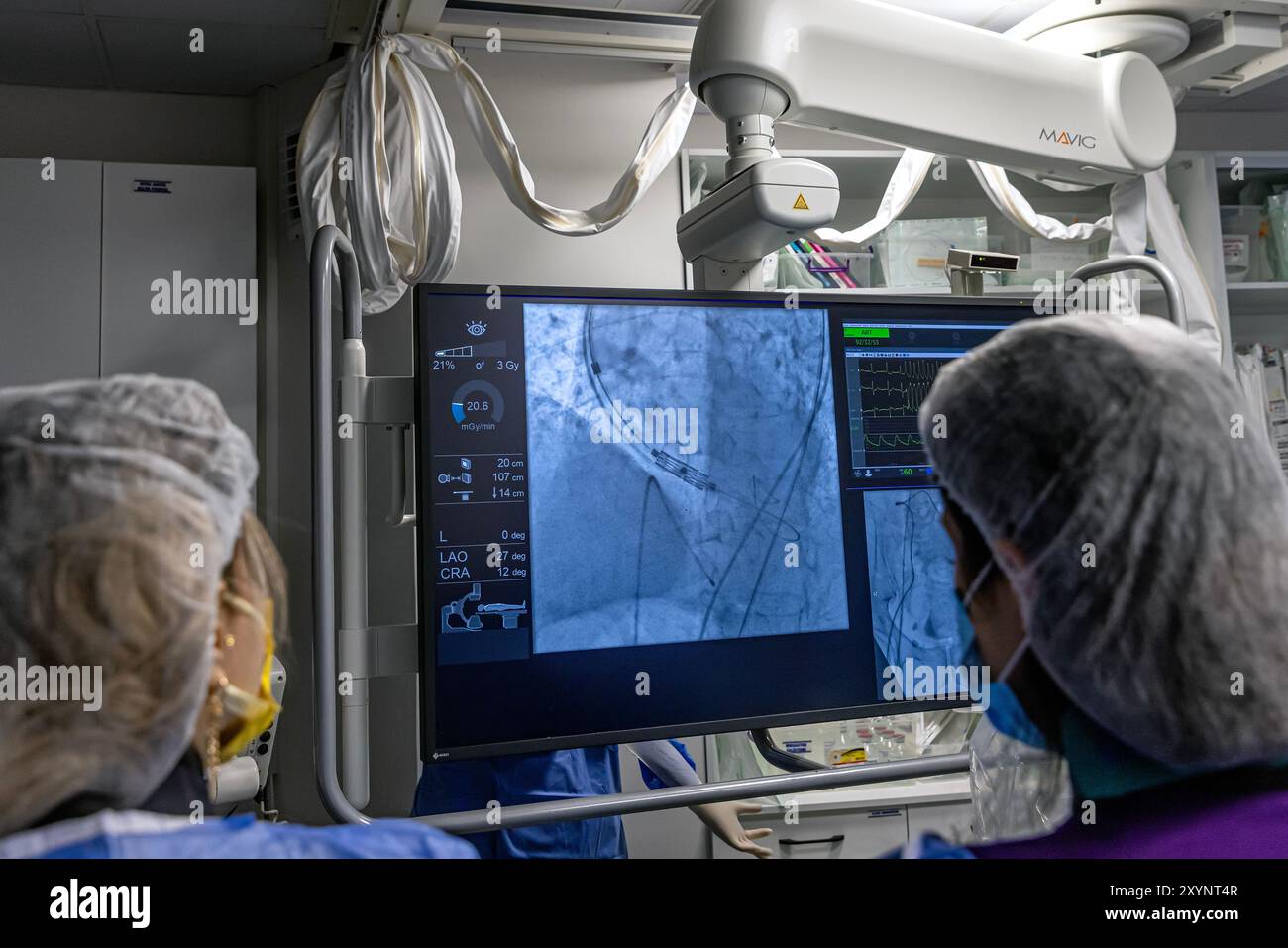 Istanbul, Turkey February 29, 2024; X-ray for valvular replacement with ...