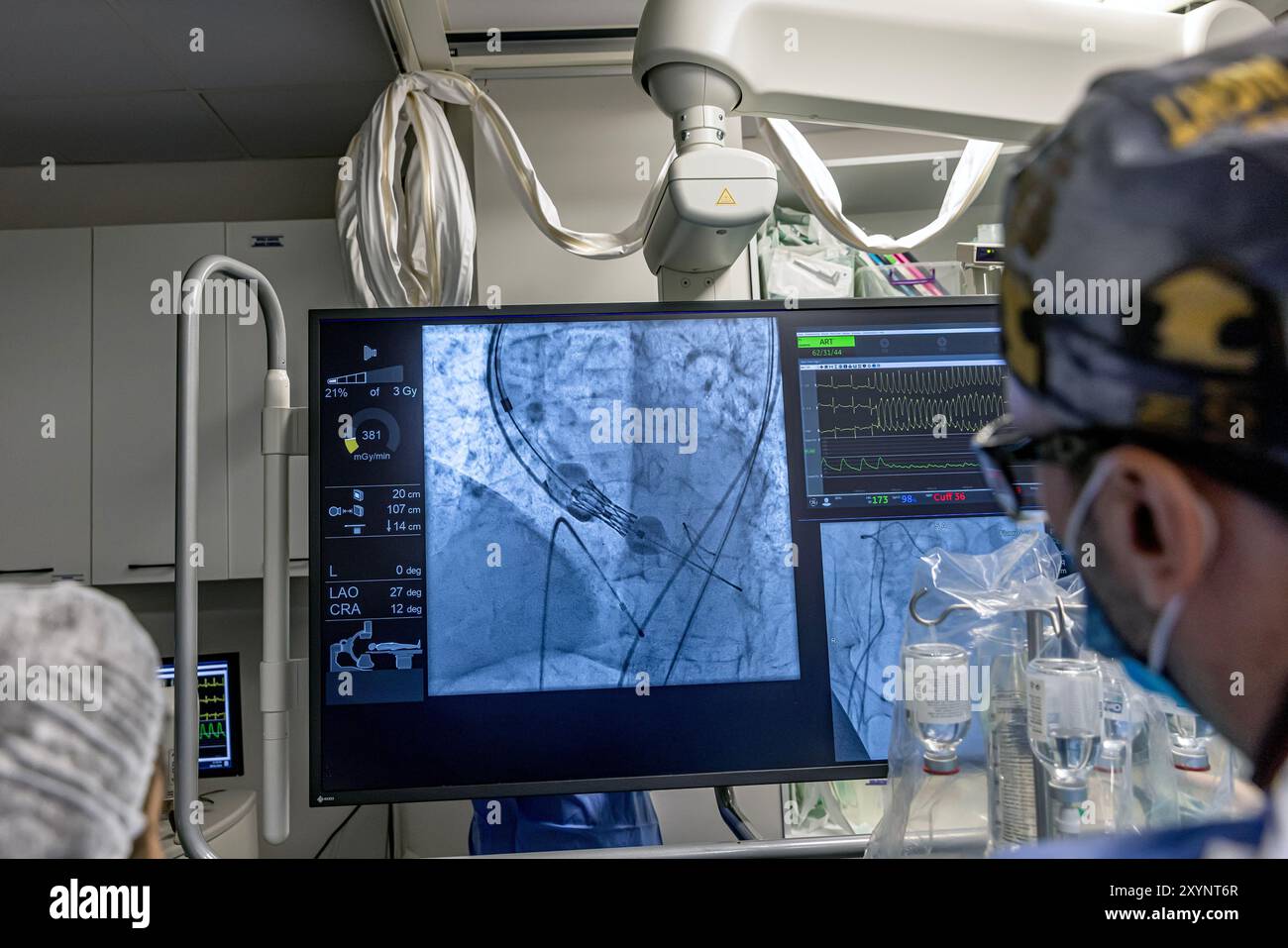 Istanbul, Turkey February 29, 2024; X-ray for valvular replacement with ...