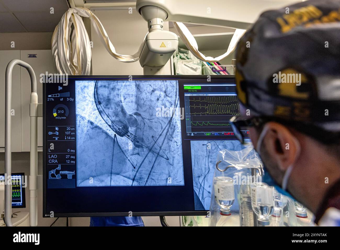 Istanbul, Turkey February 29, 2024; X-ray for valvular replacement with ...