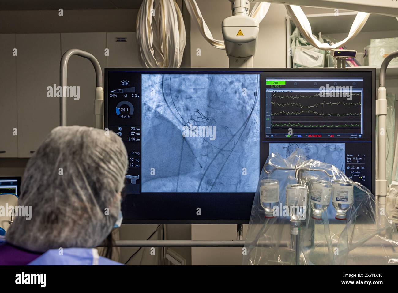 Istanbul, Turkey February 29, 2024; X-ray for valvular replacement with ...