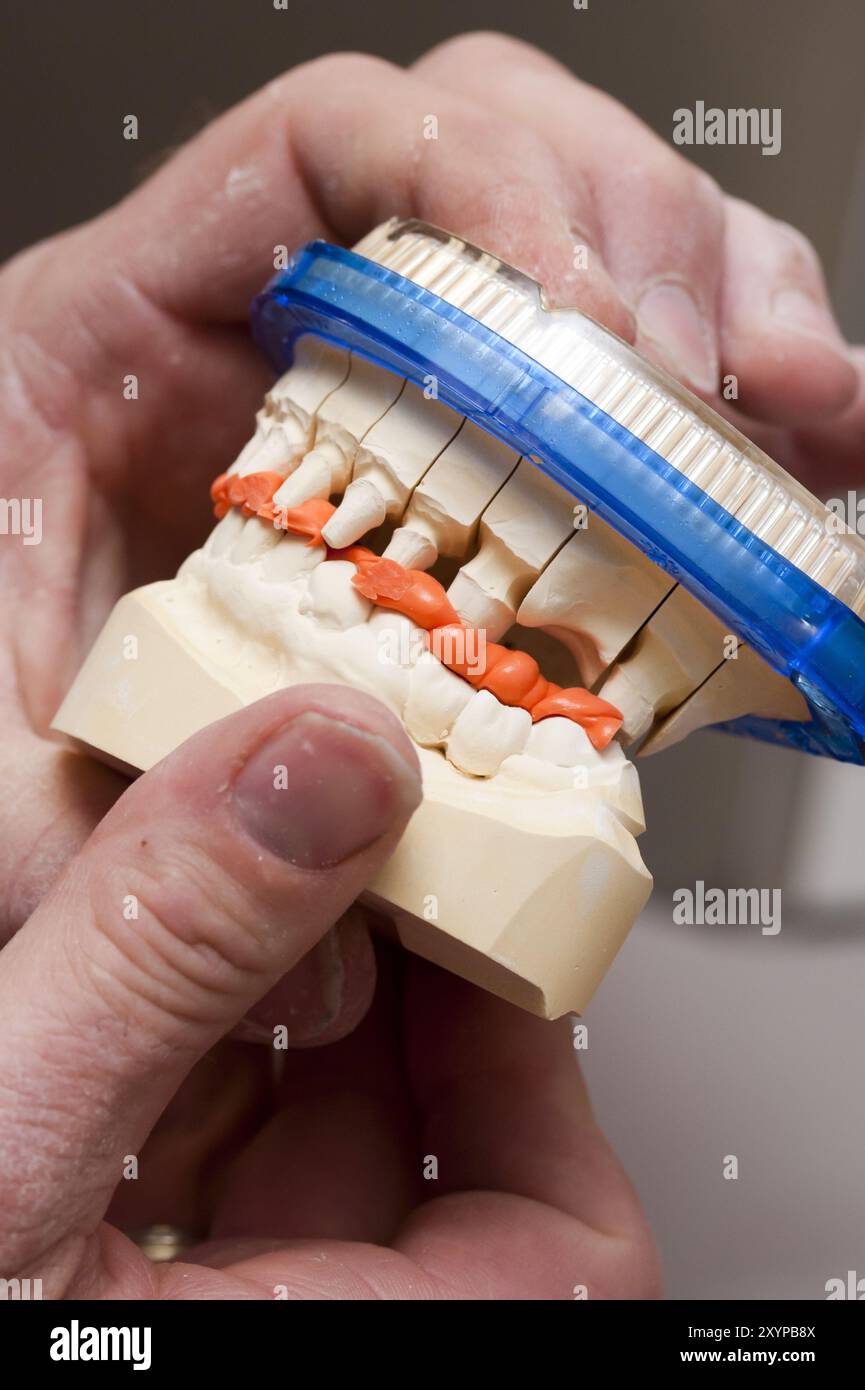 Denture model with upper and lower jaw Stock Photo - Alamy