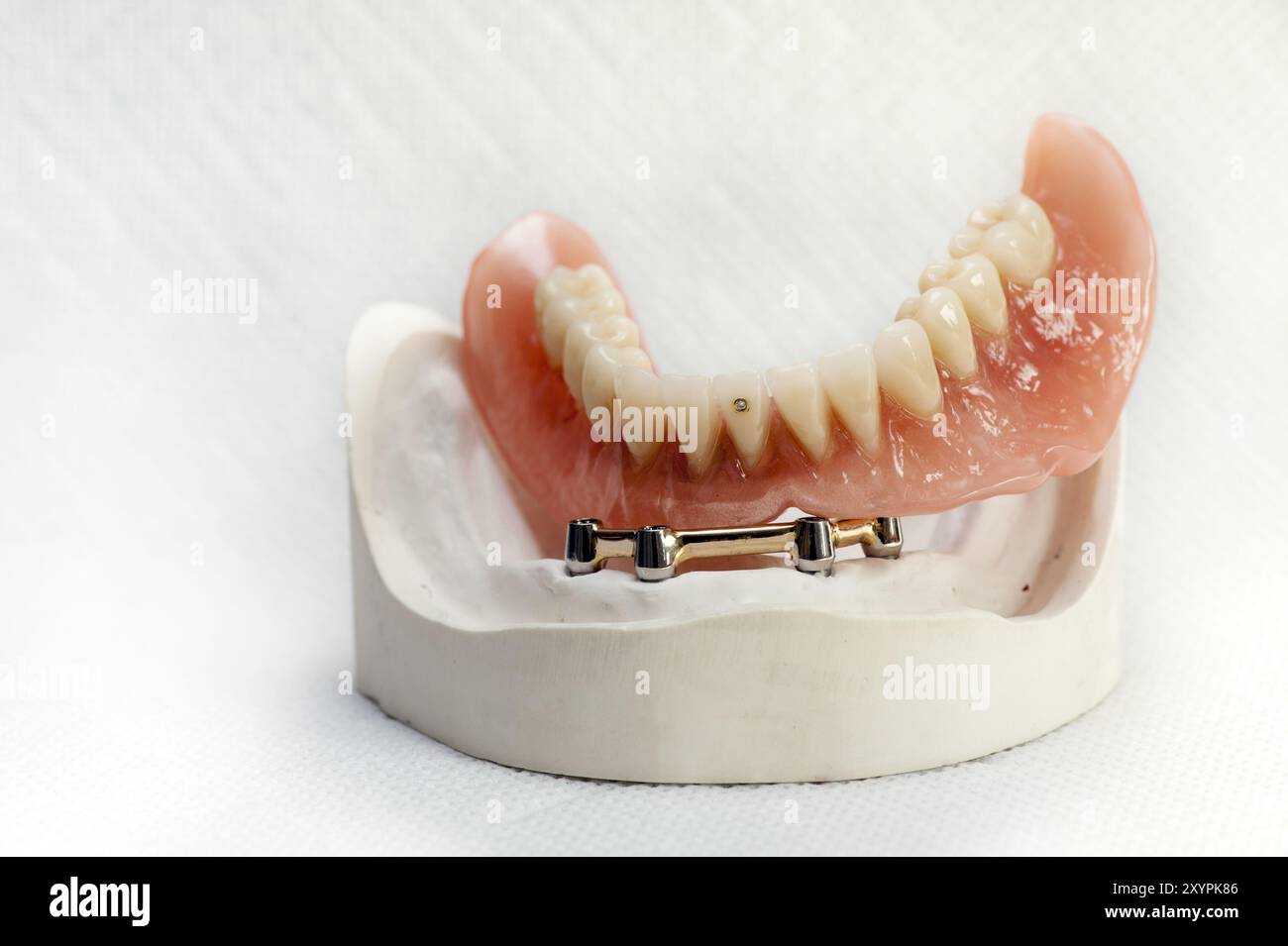 Finished denture on the jaw model Stock Photo - Alamy