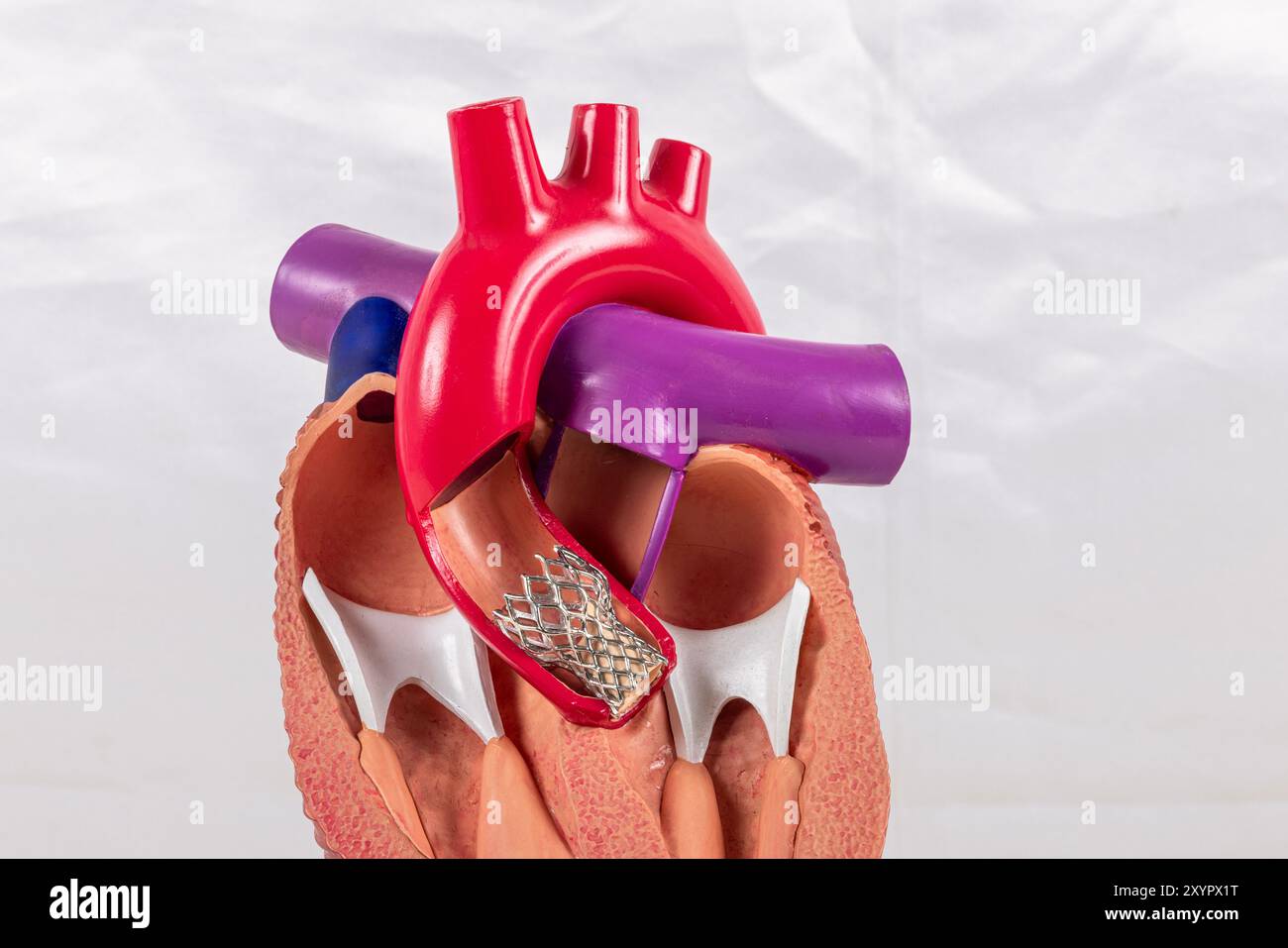 Cardiac model of Transcatheter aortic valve implantation (TAVI) for ...