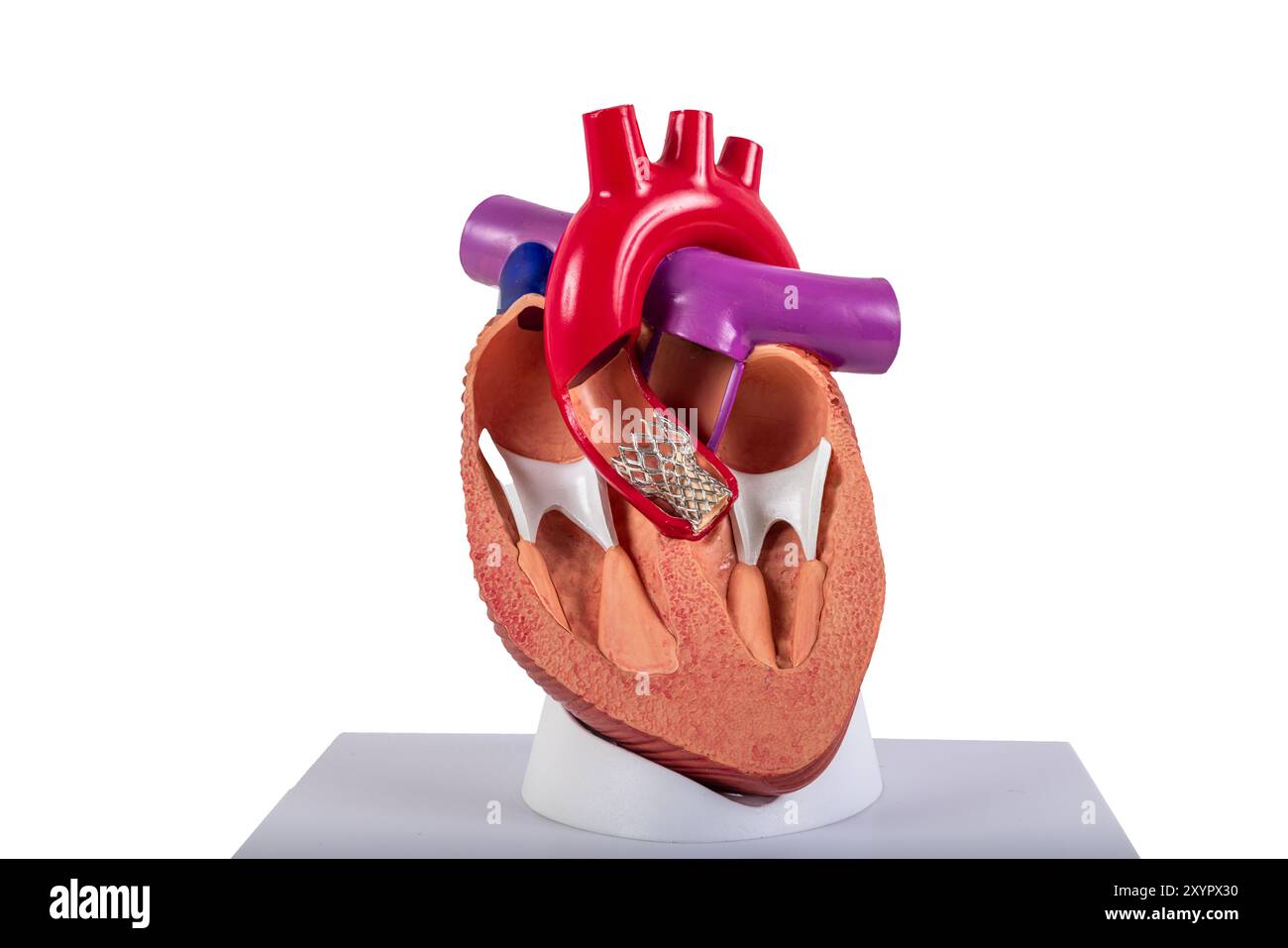Cardiac model of Transcatheter aortic valve implantation (TAVI) for ...