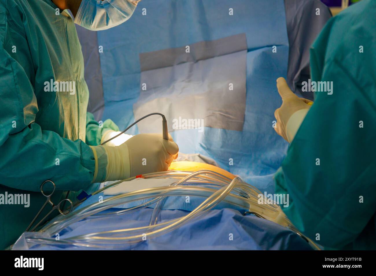 Doctors prepare a patient for surgery on operating table before ...