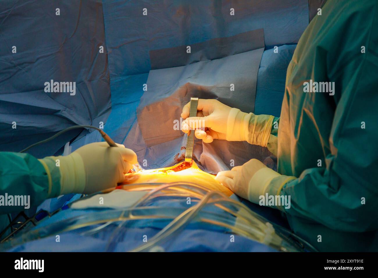 Doctor prepares patient for surgery on operating table in hospital ...