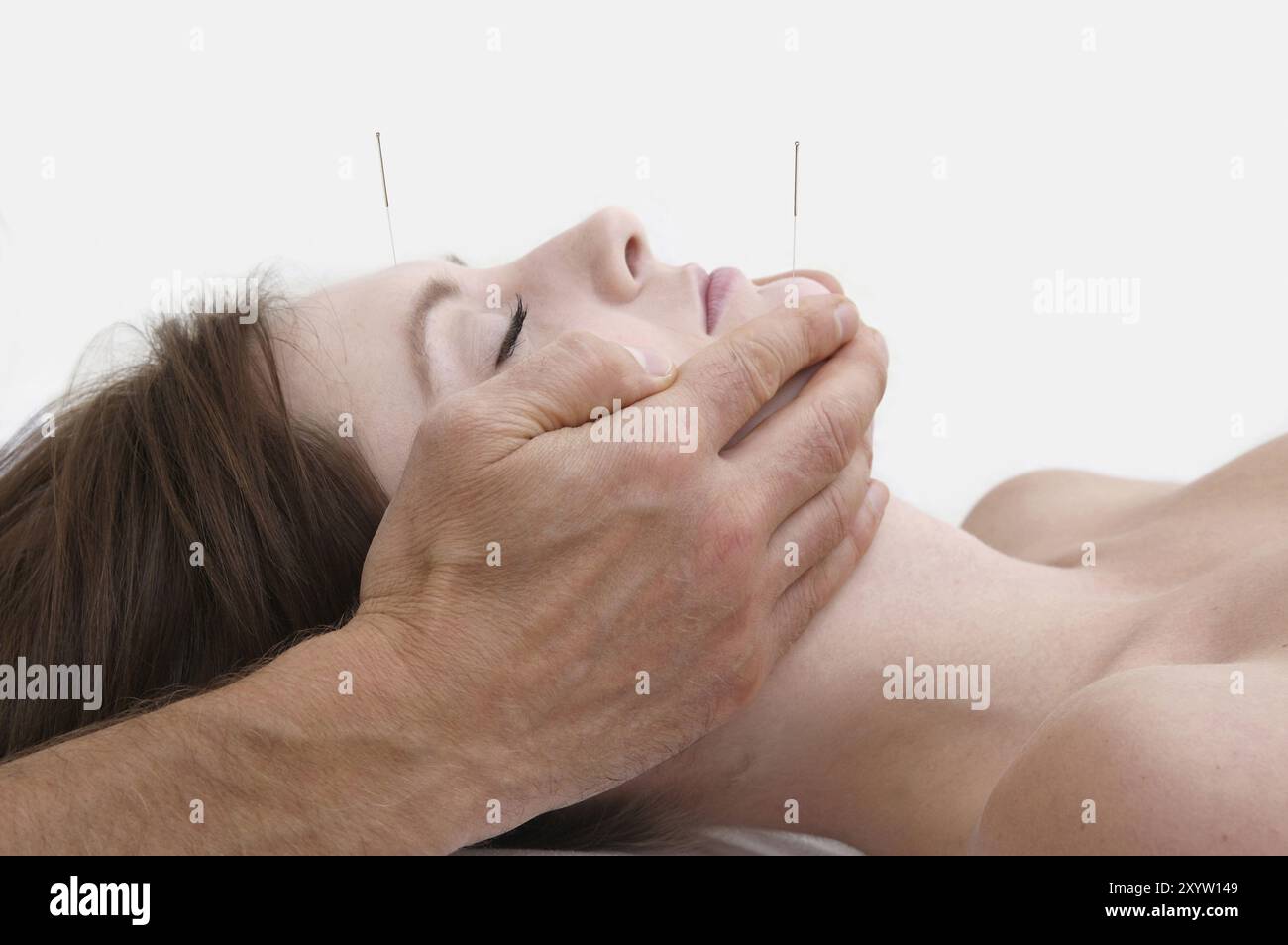 Single needle acupuncture hi-res stock photography and images - Alamy