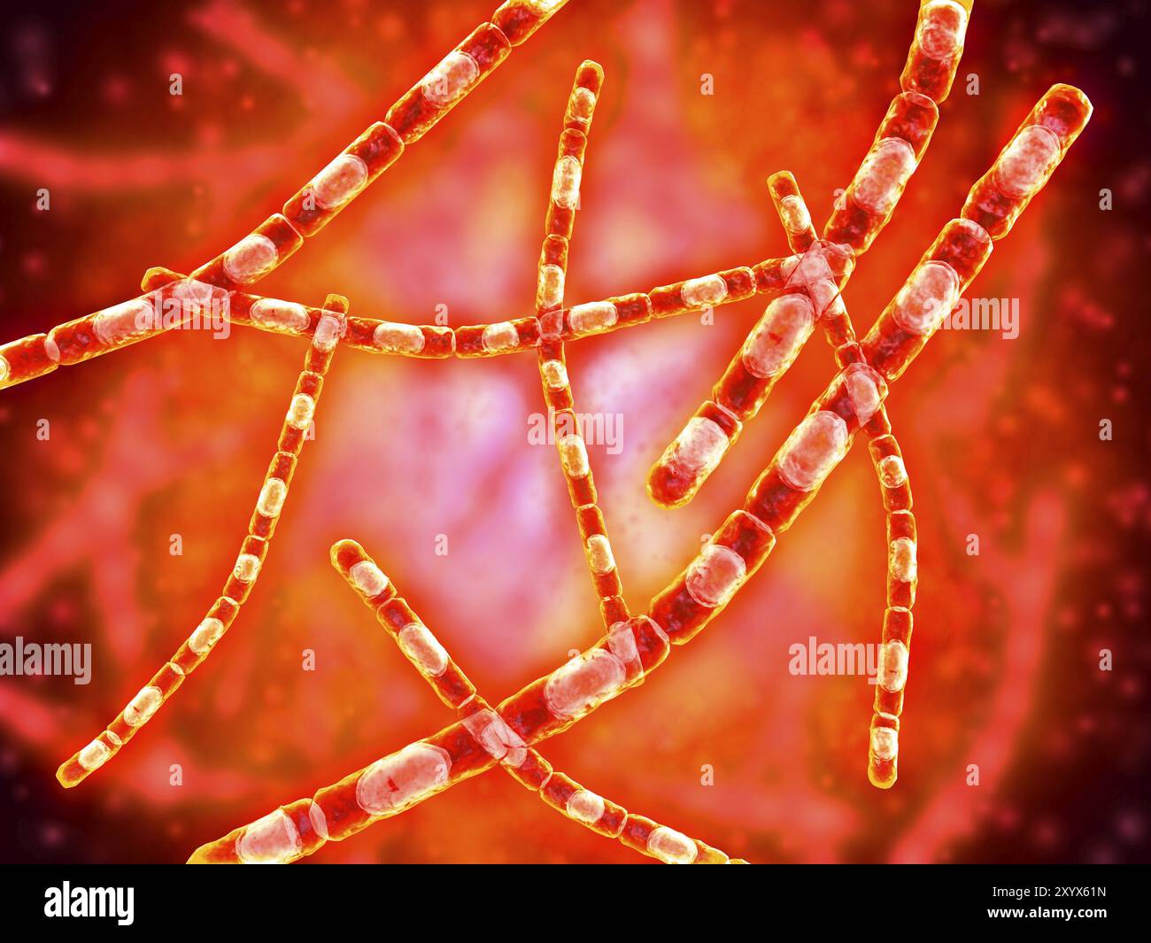Microscopic view of Anthrax. Anthrax is an acute disease caused by the ...