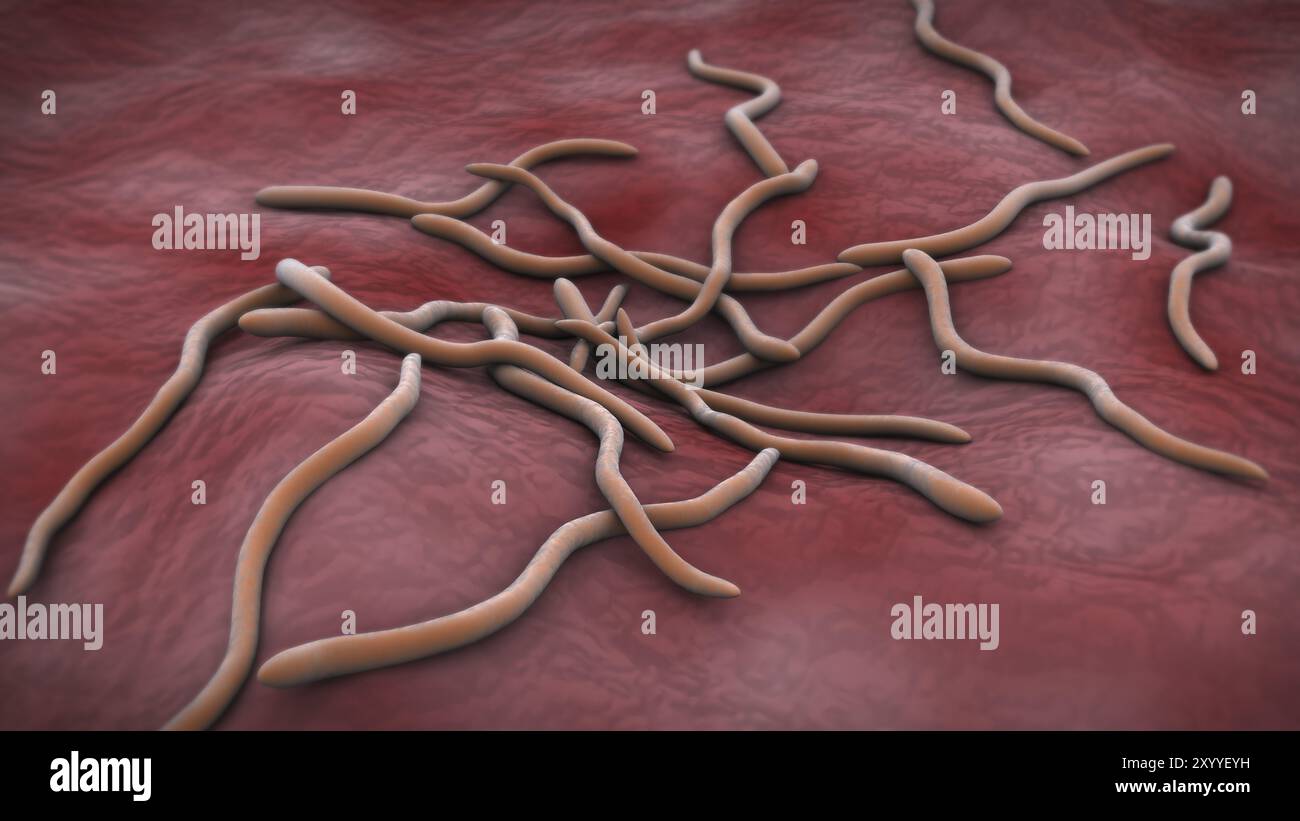 Borrelia burgdorferi hi-res stock photography and images - Alamy