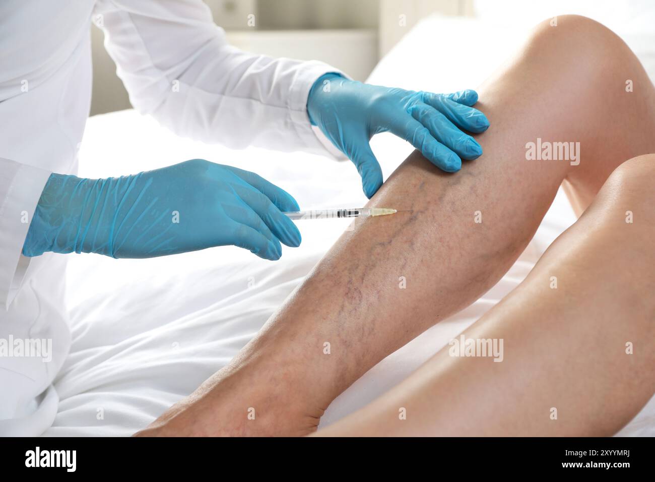Varicose veins treatment. Doctor giving injection to patient indoors ...