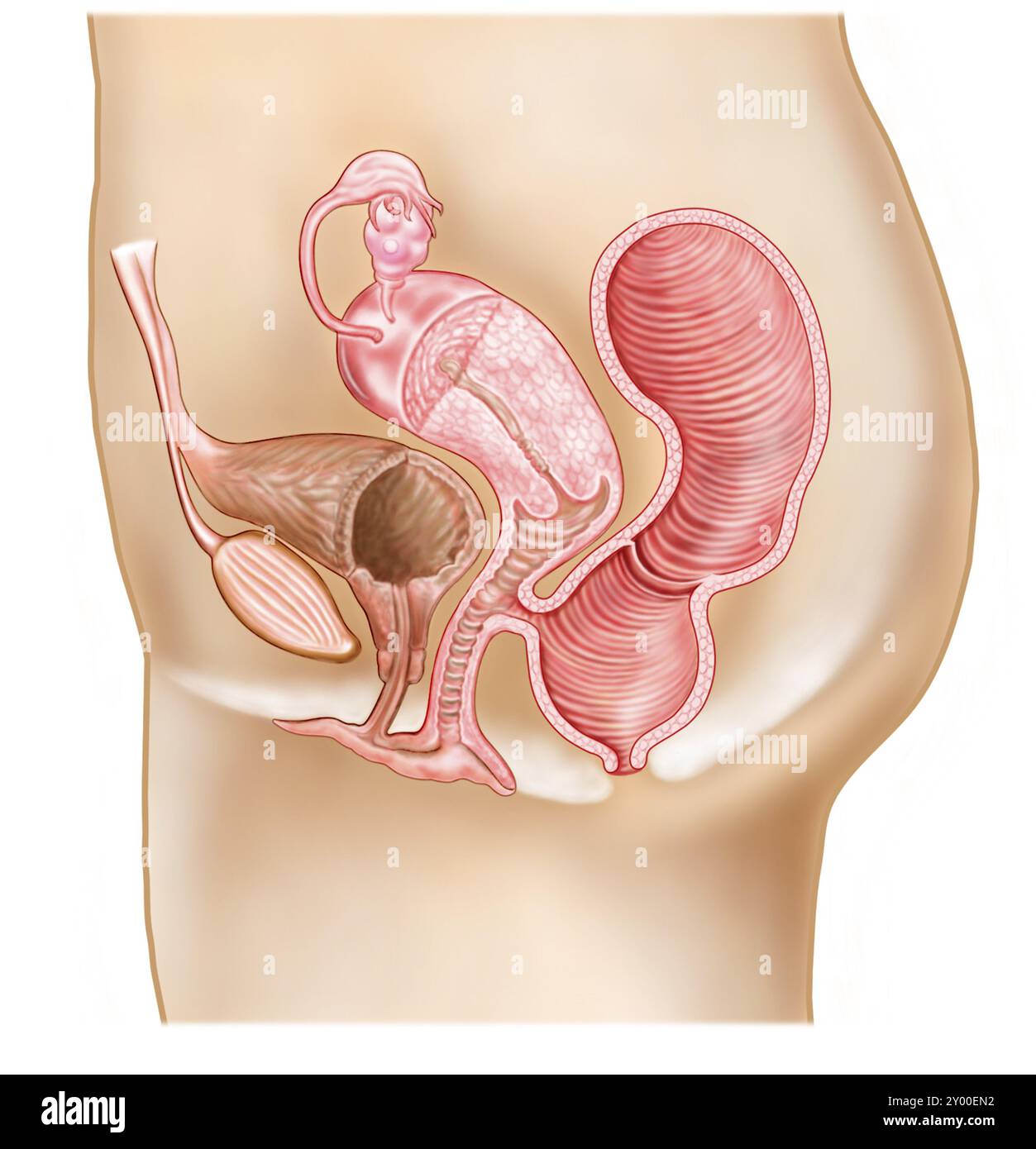 Rectovaginal Fistula And Cross Section Of Female Reproductive Organs