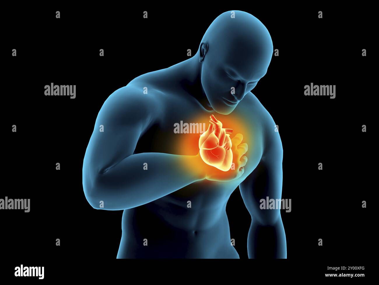 Heart attack artwork hi-res stock photography and images - Alamy