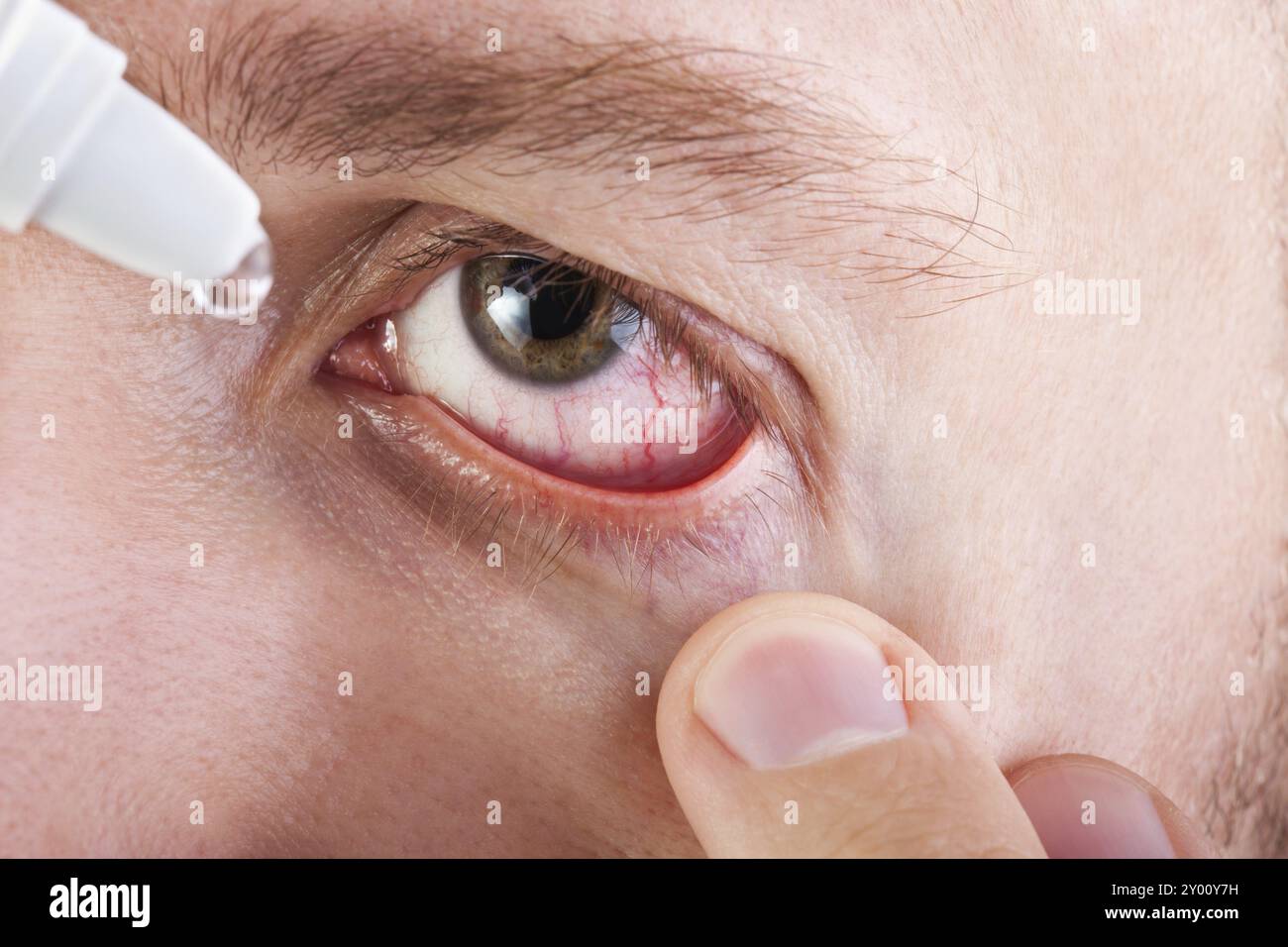 Medicine healthcare liquid eyedropper on human eye Stock Photo - Alamy