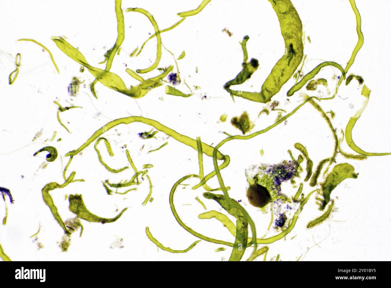 Marine green microalgae under the microscope in front of a white ...