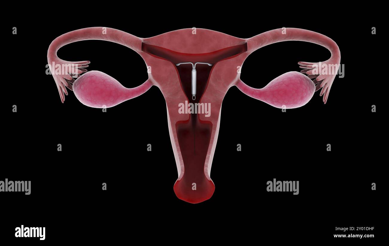 Female internal organs artwork hi-res stock photography and images - Alamy