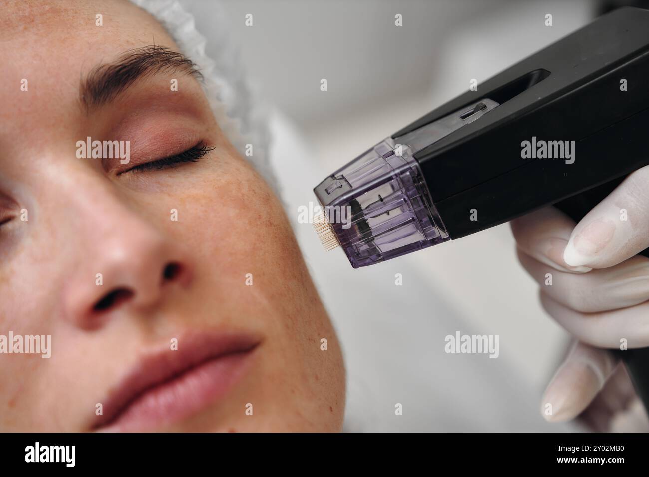 Micropuncture hi-res stock photography and images - Alamy