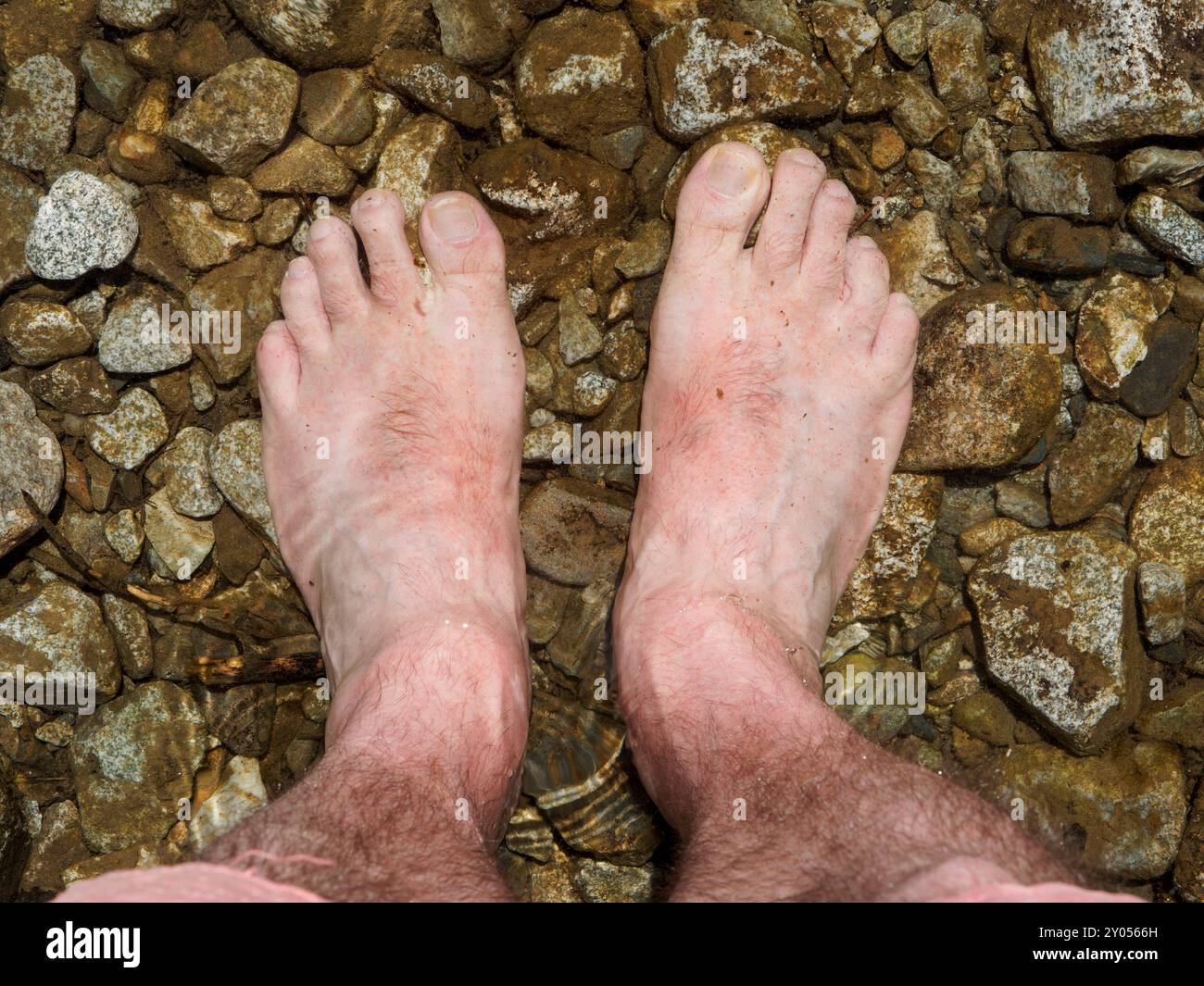 Cryotherapy, putting your feet in cold water. feet immersed in the ...