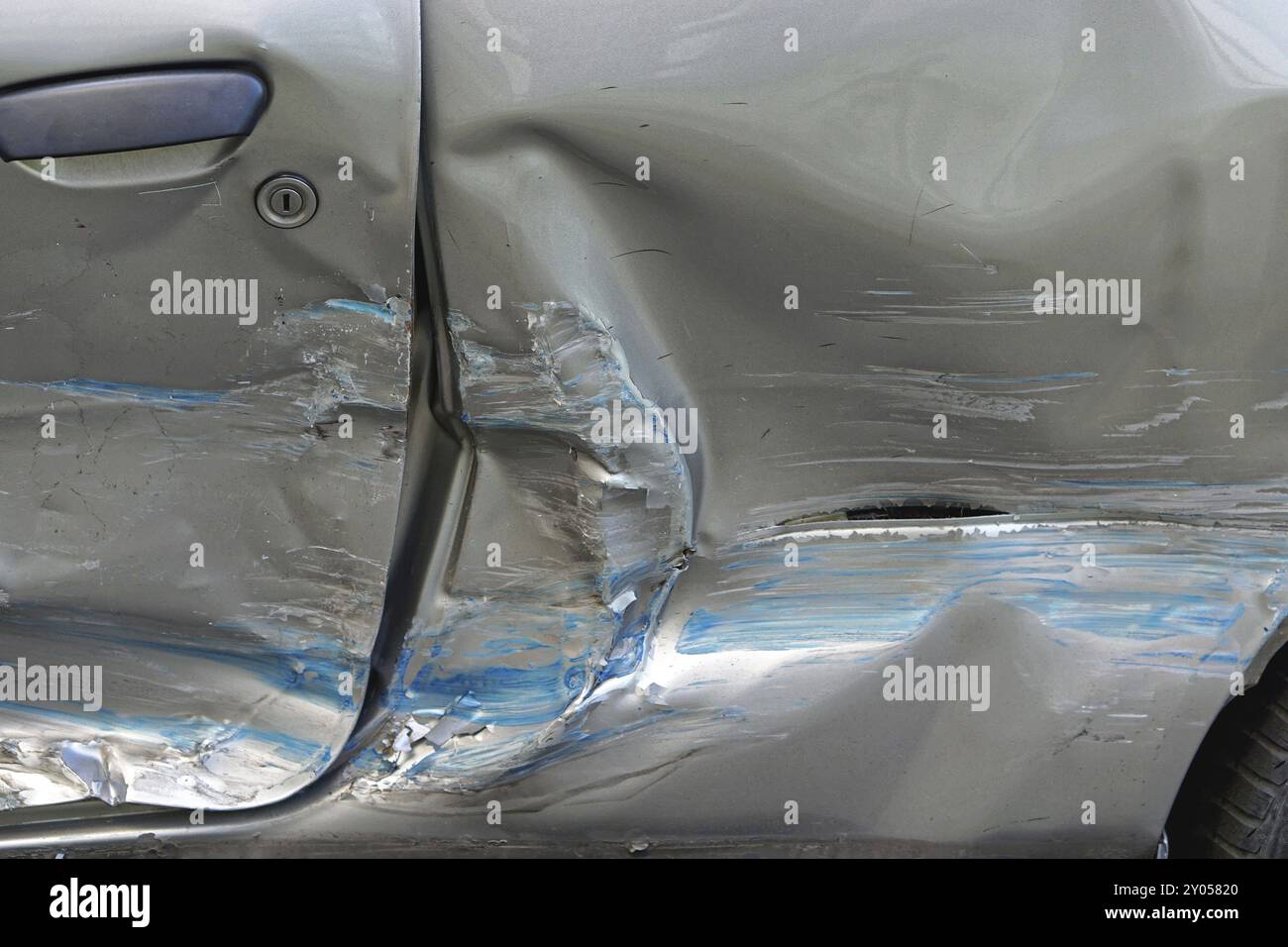 Damage body parts hi-res stock photography and images - Alamy