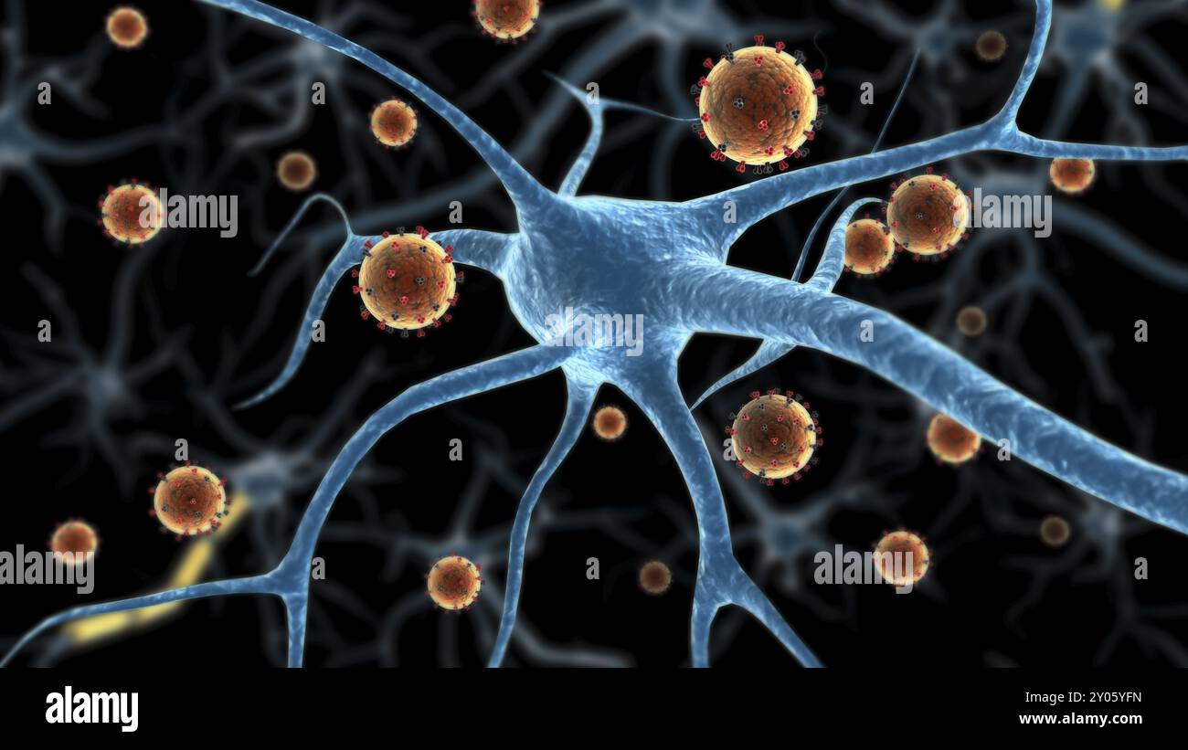 Biomedical illustration of the eastern equine encephalitis disease ...