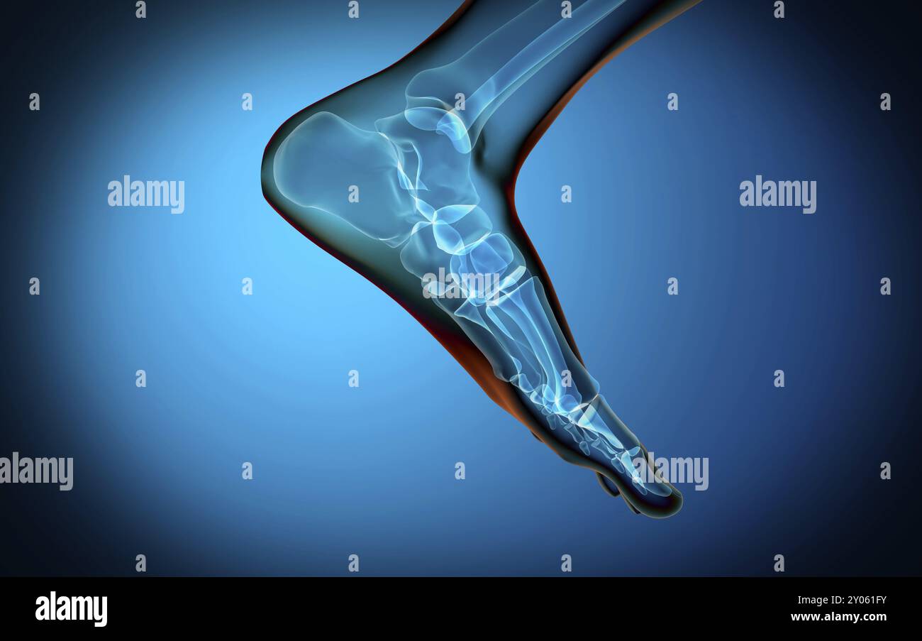 X-ray view of human foot Stock Photo - Alamy