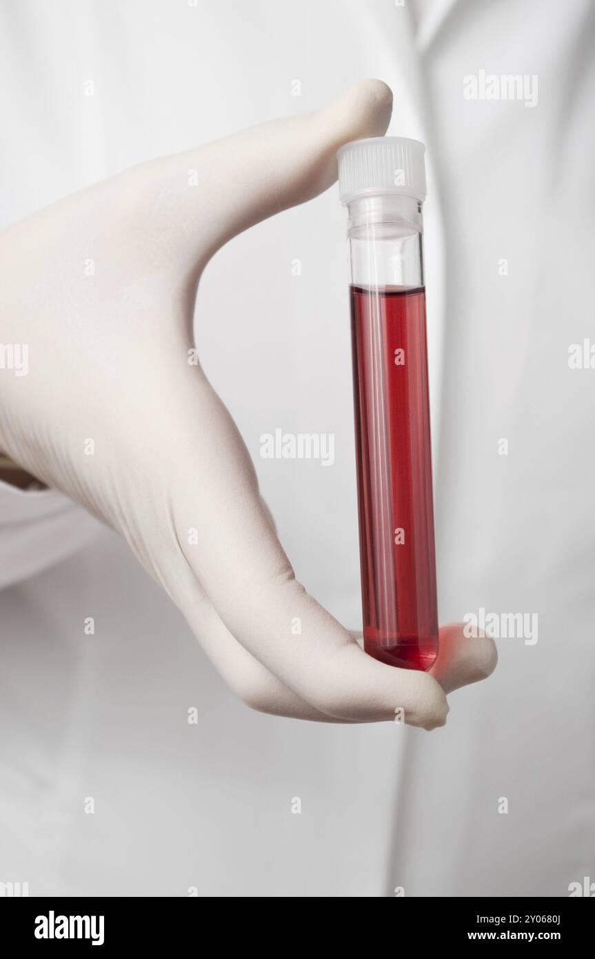 Blood sample drawing hi-res stock photography and images - Alamy