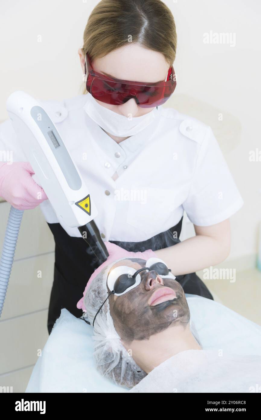 The cosmetician girl in goggles makes the procedure of carbon peeling ...